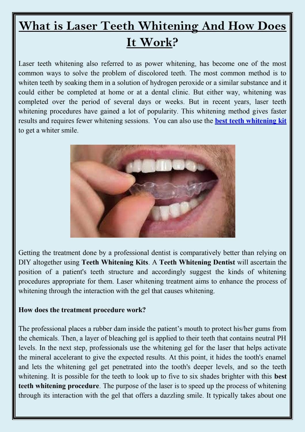 What is Laser Teeth Whitening And How Does It Work? by Edge Dental - Issuu