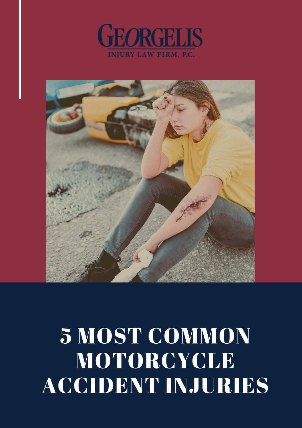 5 Most Common Motorcycle Injuries | Georgelis Injury Law Firm by ...