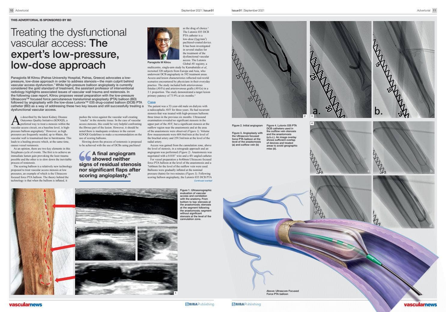 BD Ultrascore advertorial by BIBA Publishing - Issuu