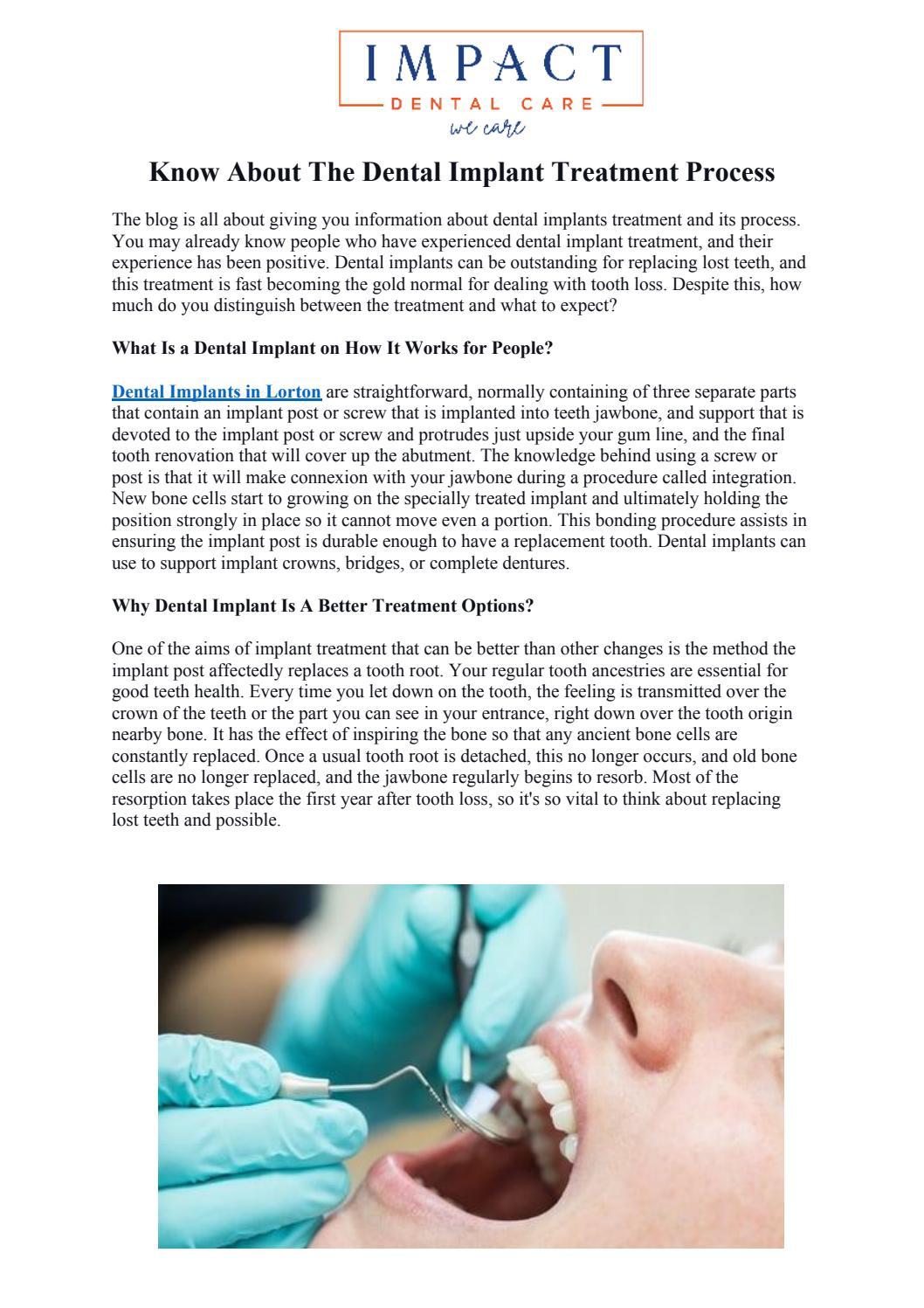 Know About The Dental Implant Treatment Process by Impact Dental Care ...