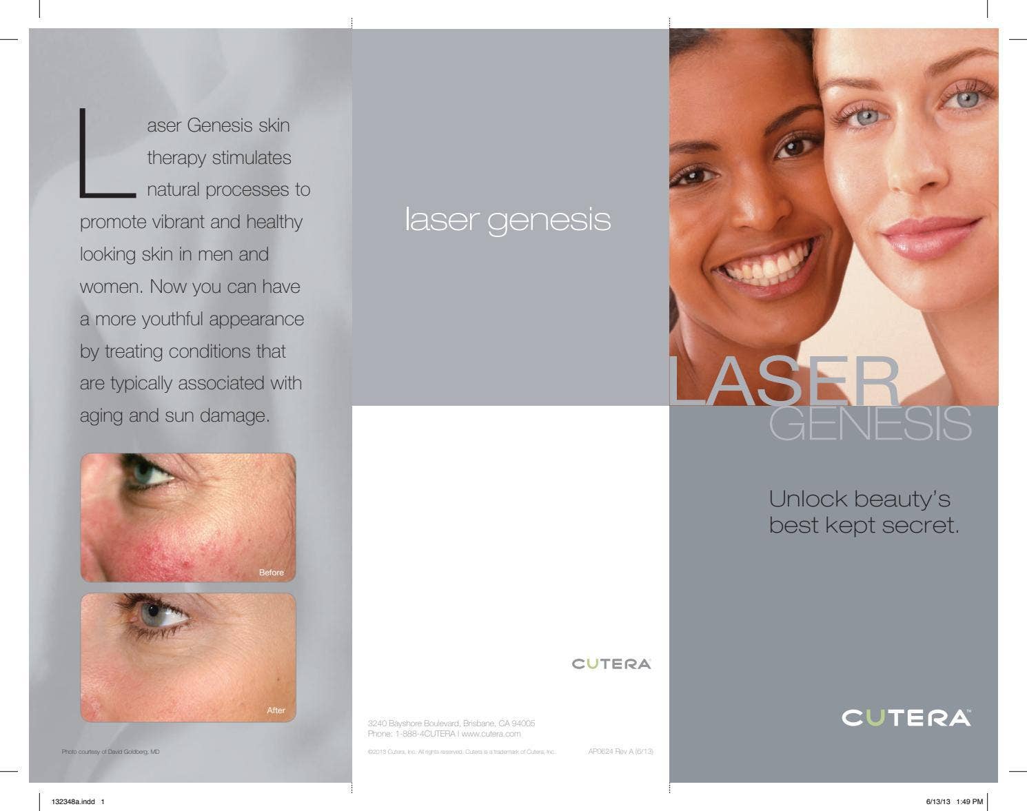 Laser Genesis (excel V and xeo) Patient Pamphlet by Cutera - Issuu