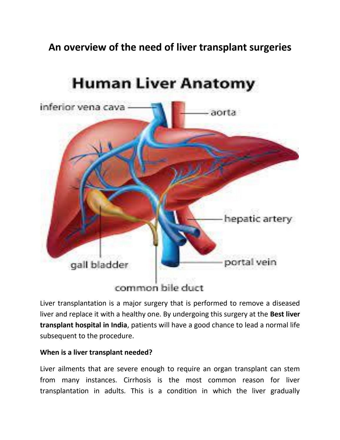An overview of the need of liver transplant surgeries by Transplantliver - Issuu