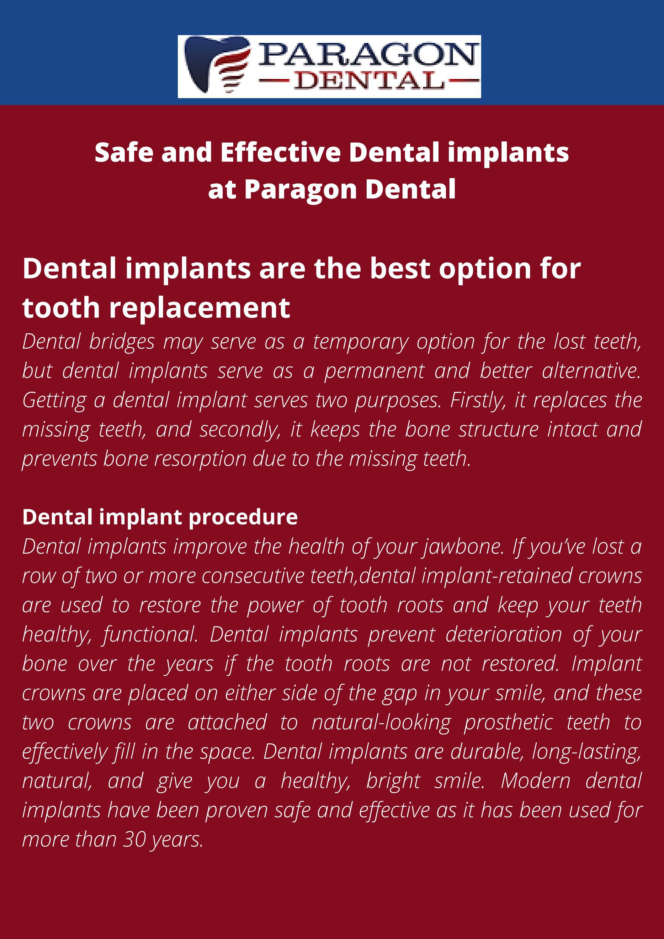 Safe and Effective Dental implantsat Paragon Dental by paragondental ...