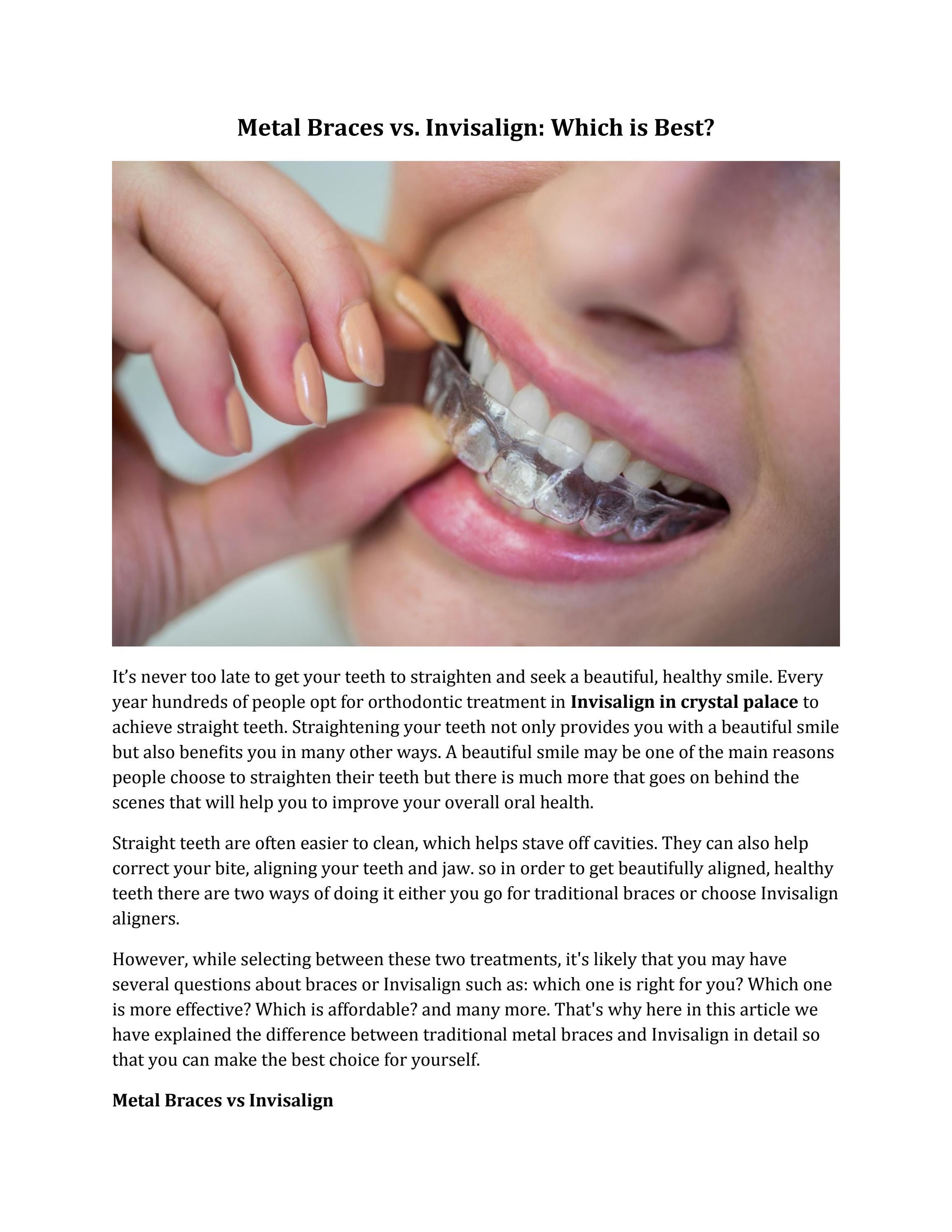Metal Braces vs. Invisalign: Which is Best? by mindfuldentistlondon - Issuu