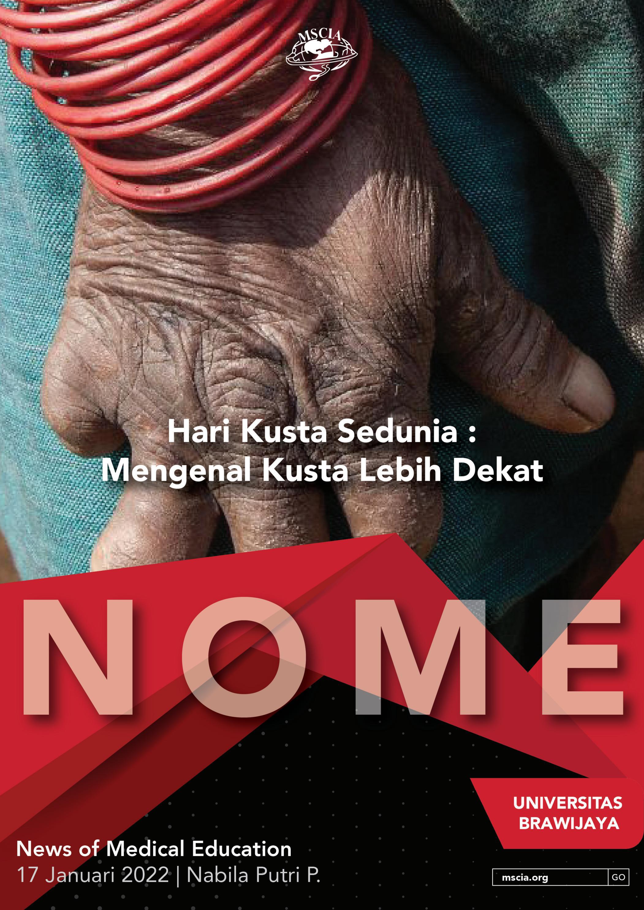 Hari Kusta Sedunia : Mengenal Kusta Lebih Dekat by MSCIA Brawijaya - Issuu