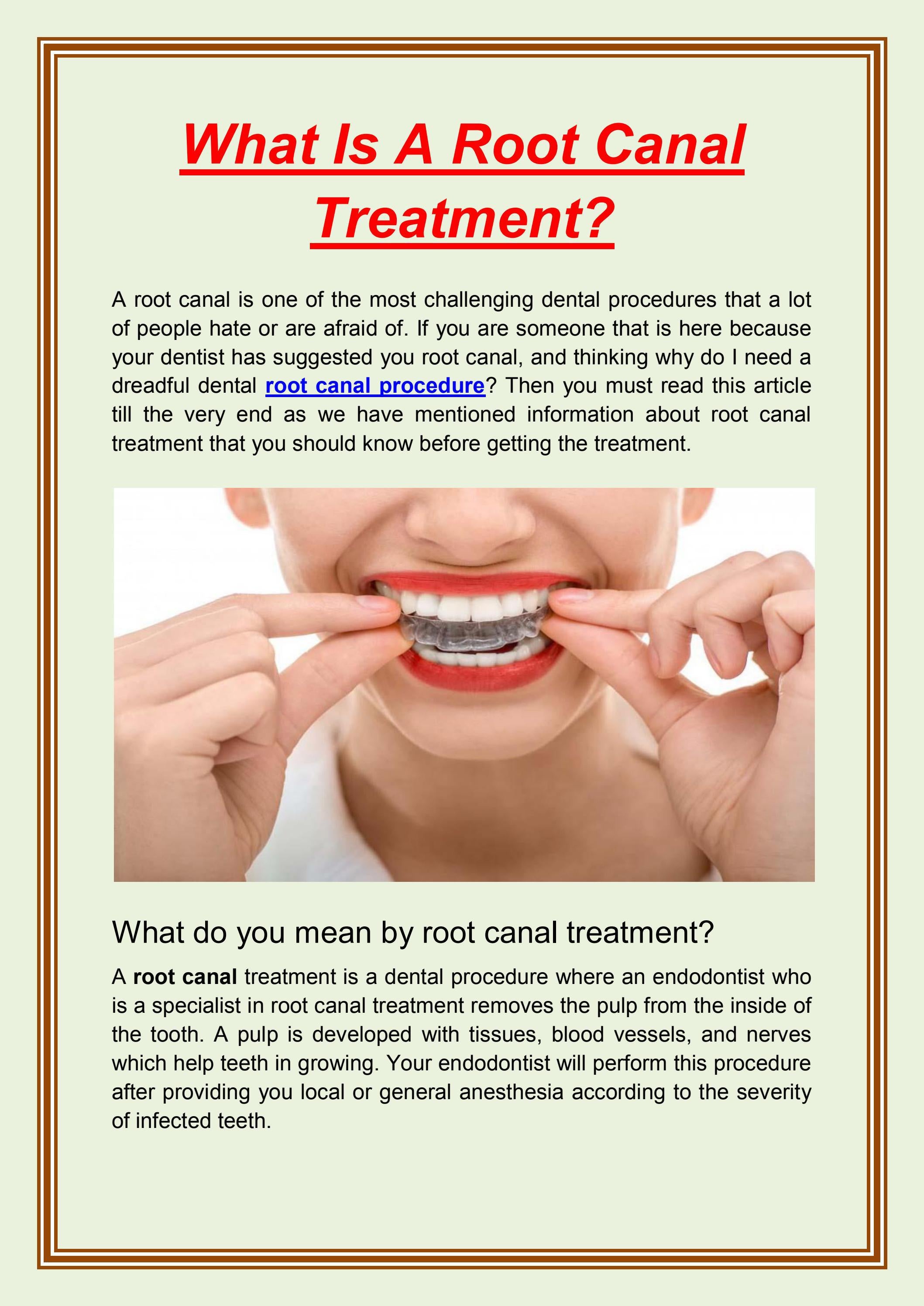 What Is A Root Canal Treatment? by Edge Dental - Issuu