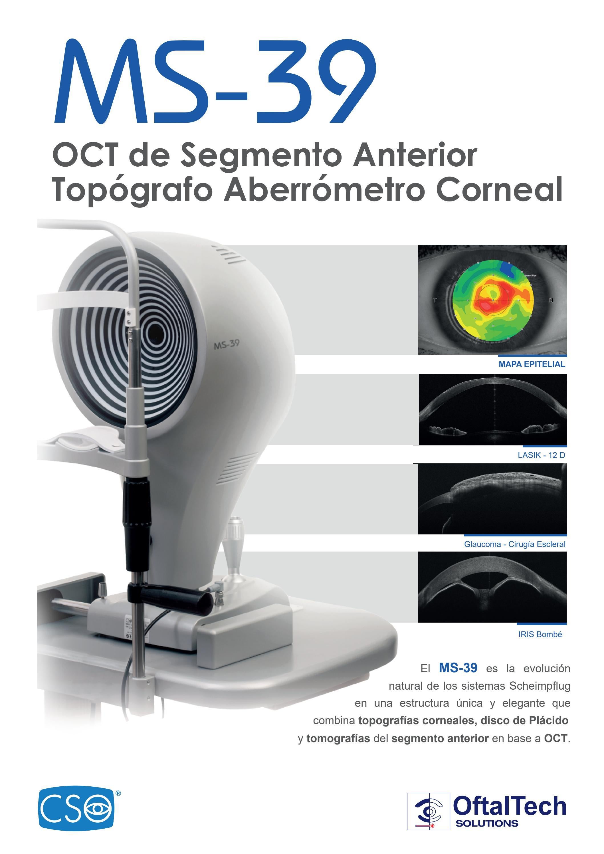 OftalTech OCT MS-39 by OftalTech Solutions - Issuu