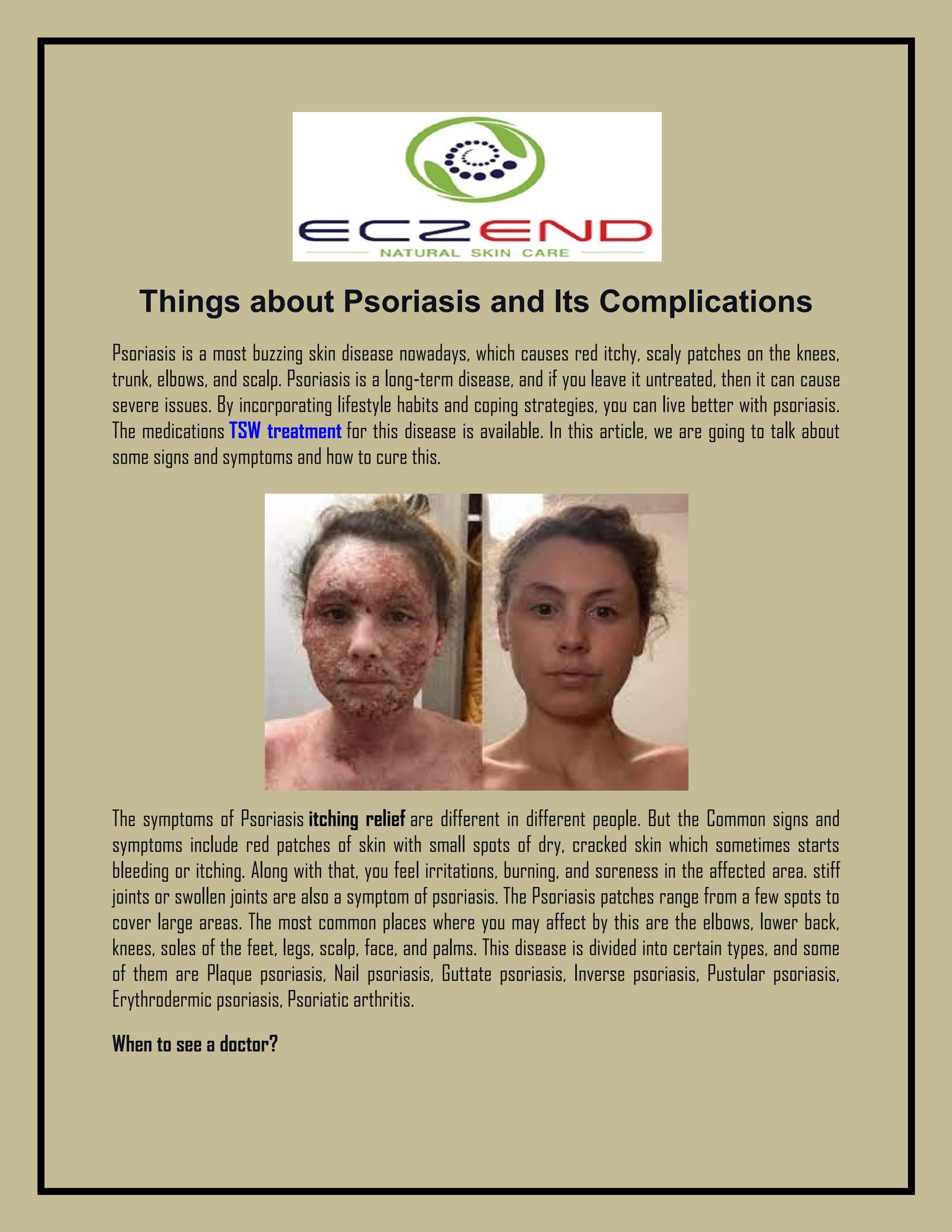 Things about Psoriasis and Its Complications by Eczend - Issuu