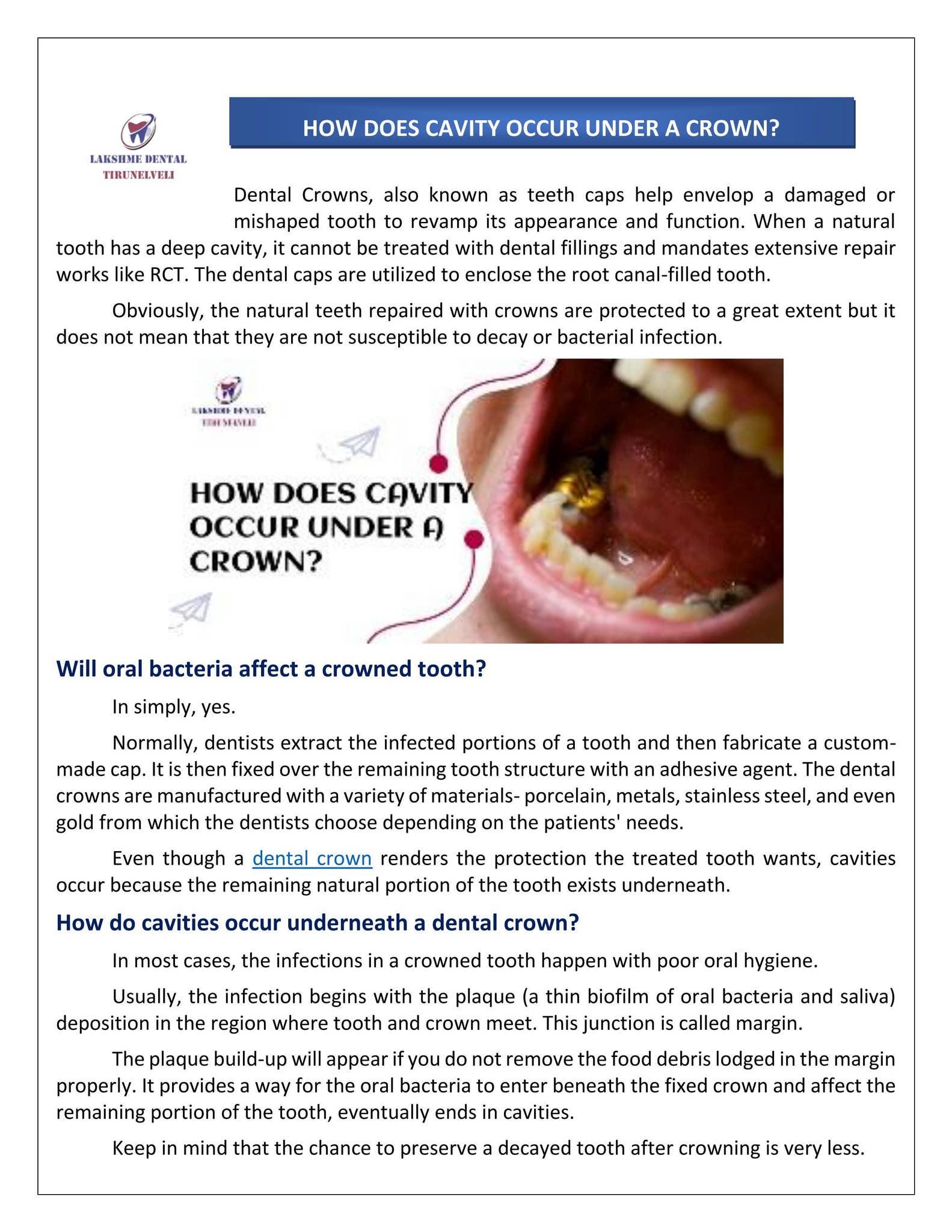 How does cavity occur under a crown? by vertikapargat - Issuu