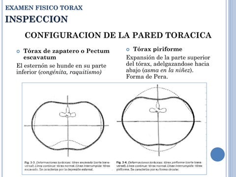 Examen físico, tórax. by Señor Enfermerock - Issuu