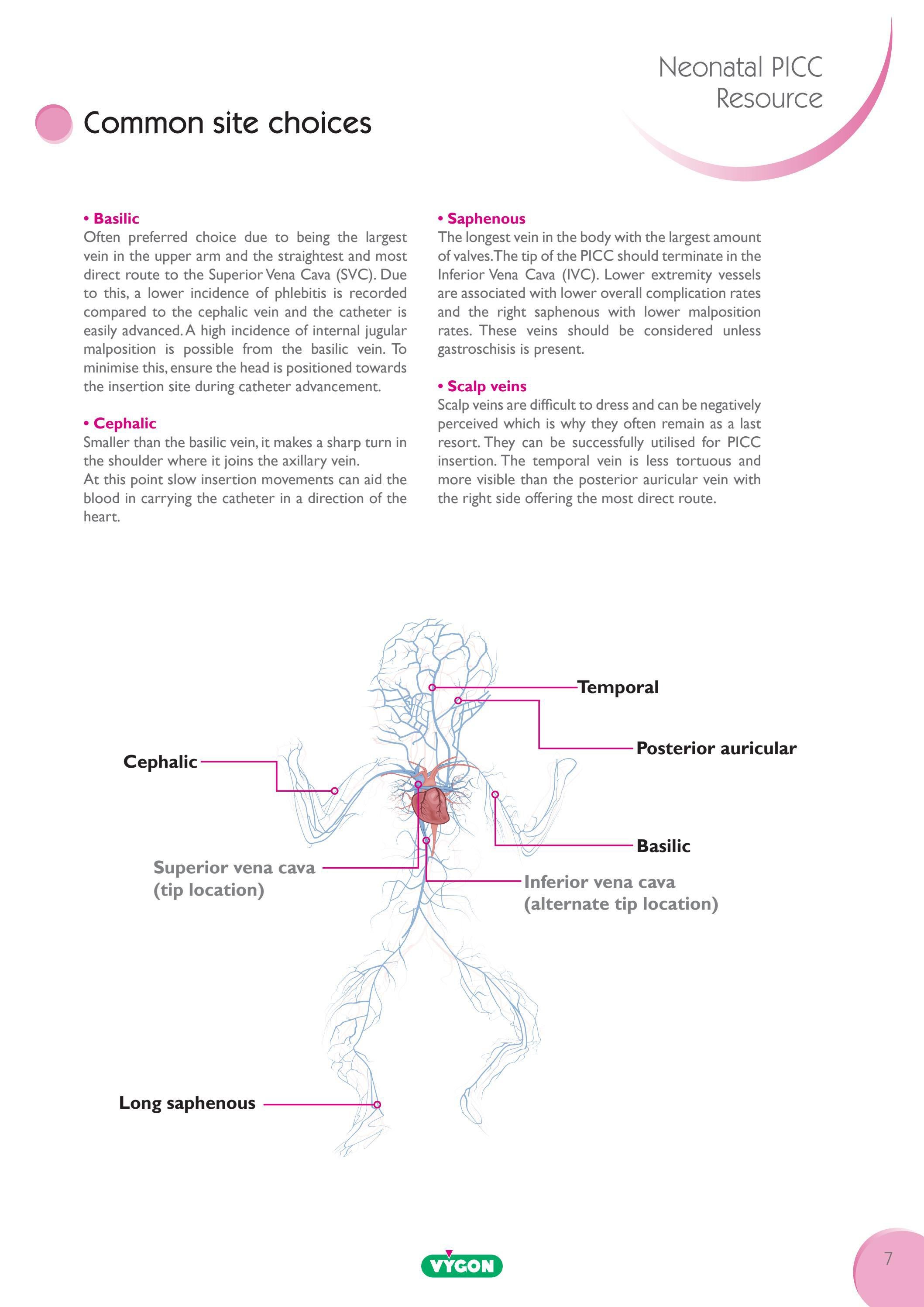Neonatal PICC Resources by VygonGroup - Issuu