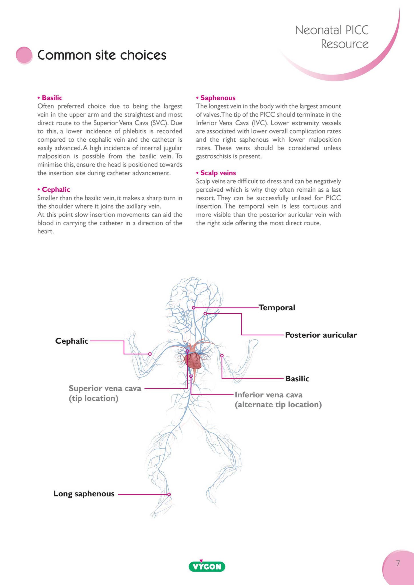 Neonatal PICC Resources by VygonGroup - Issuu