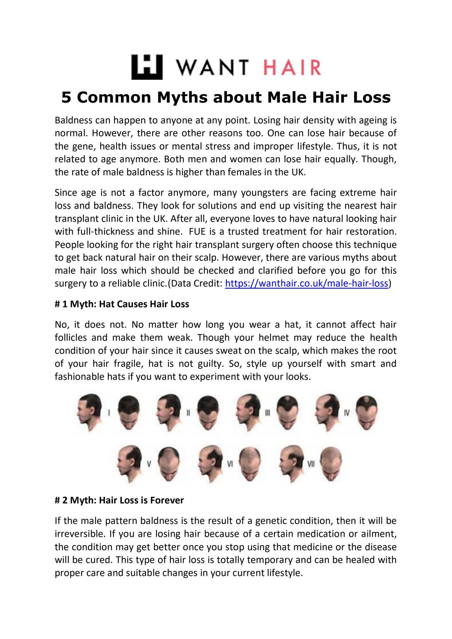 5 Common Myths about Male Hair Loss by Want Hair - Issuu