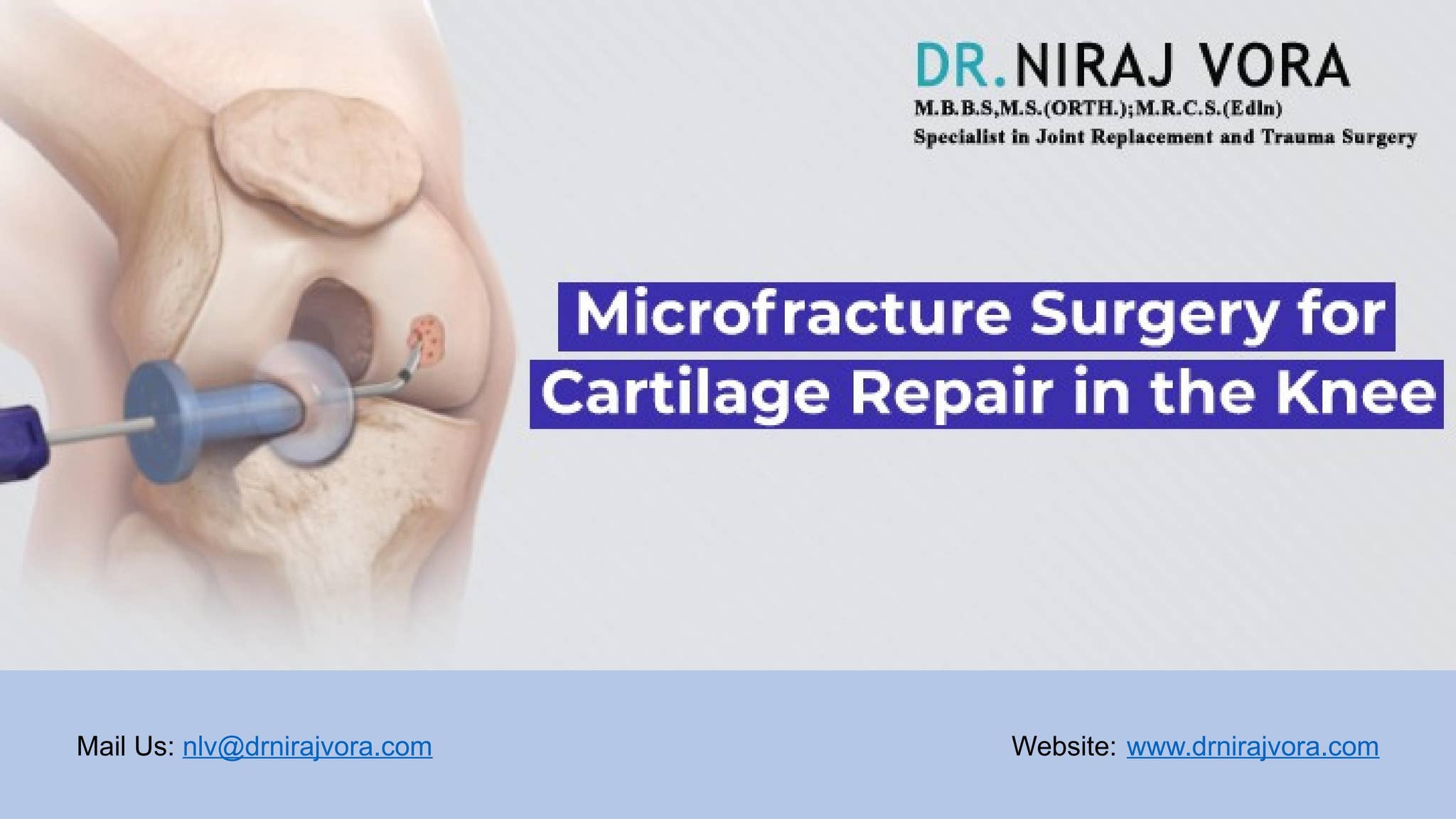 Microfracture Surgery for Cartilage Repair in the Knee | Dr Niraj Vora ...