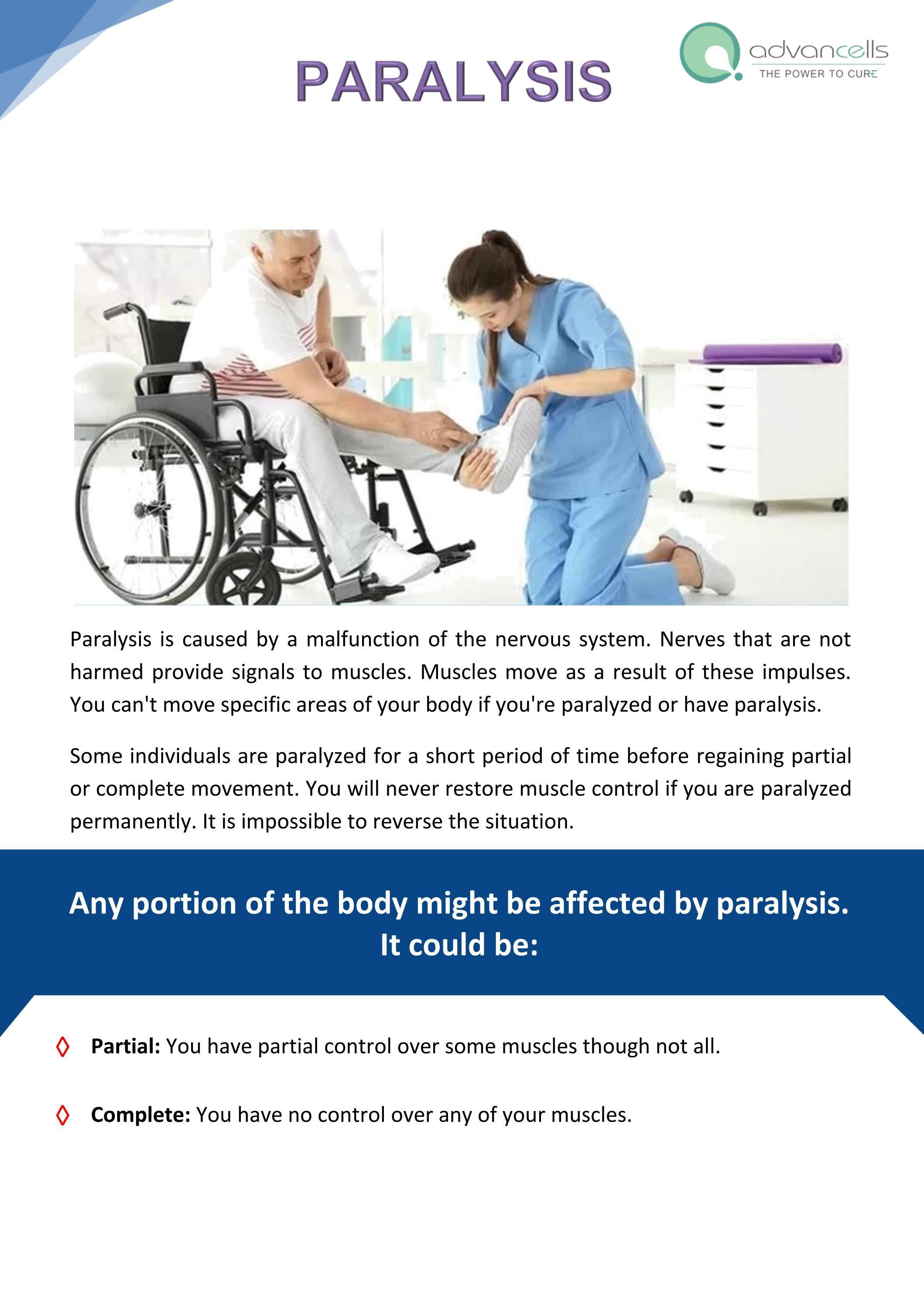 Paralysis: Causes, Symptoms, and Treatment by Advancells - Issuu