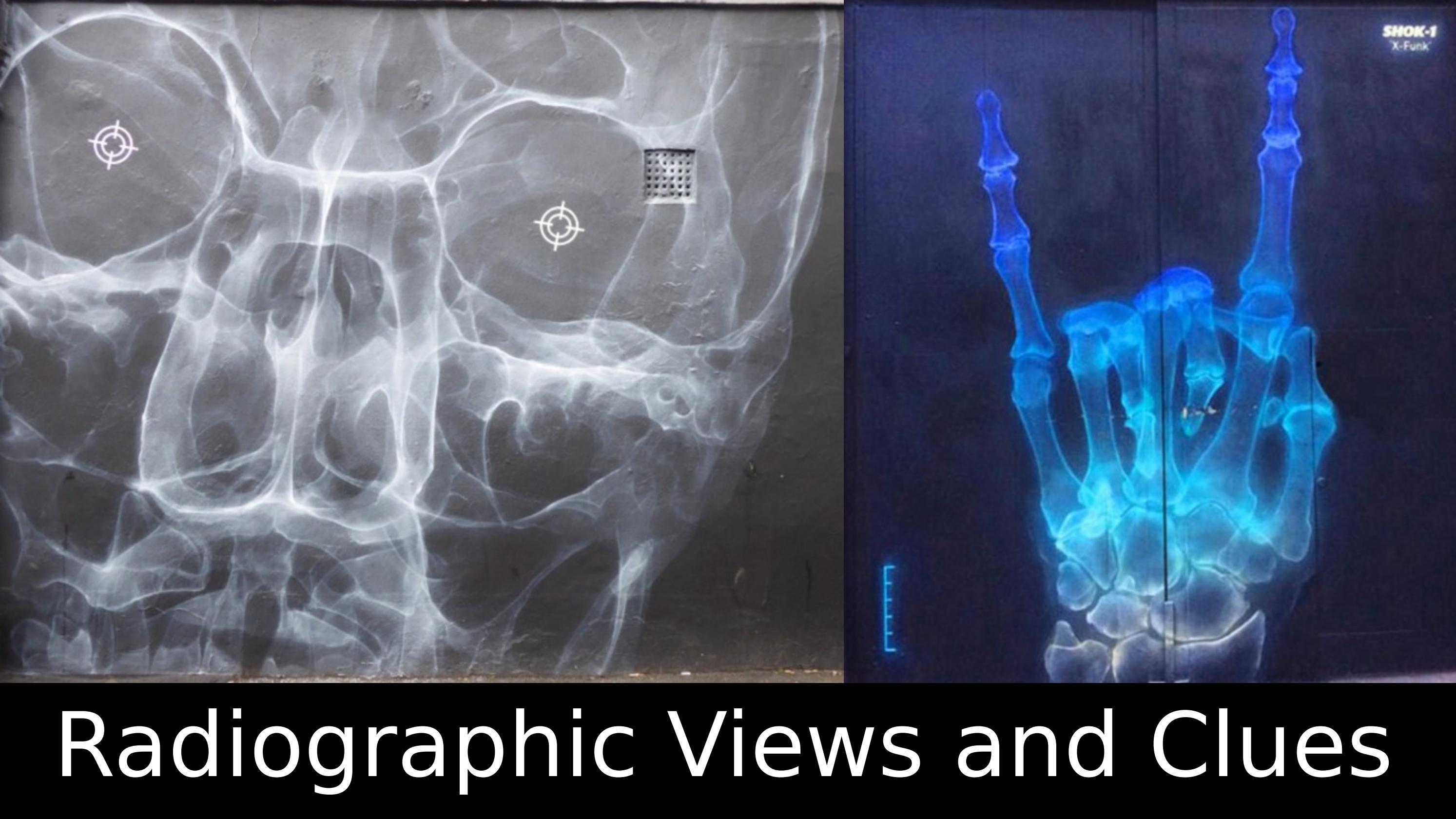 MSK Radiograph Views Dummy Version by UW Department of Radiology - Issuu