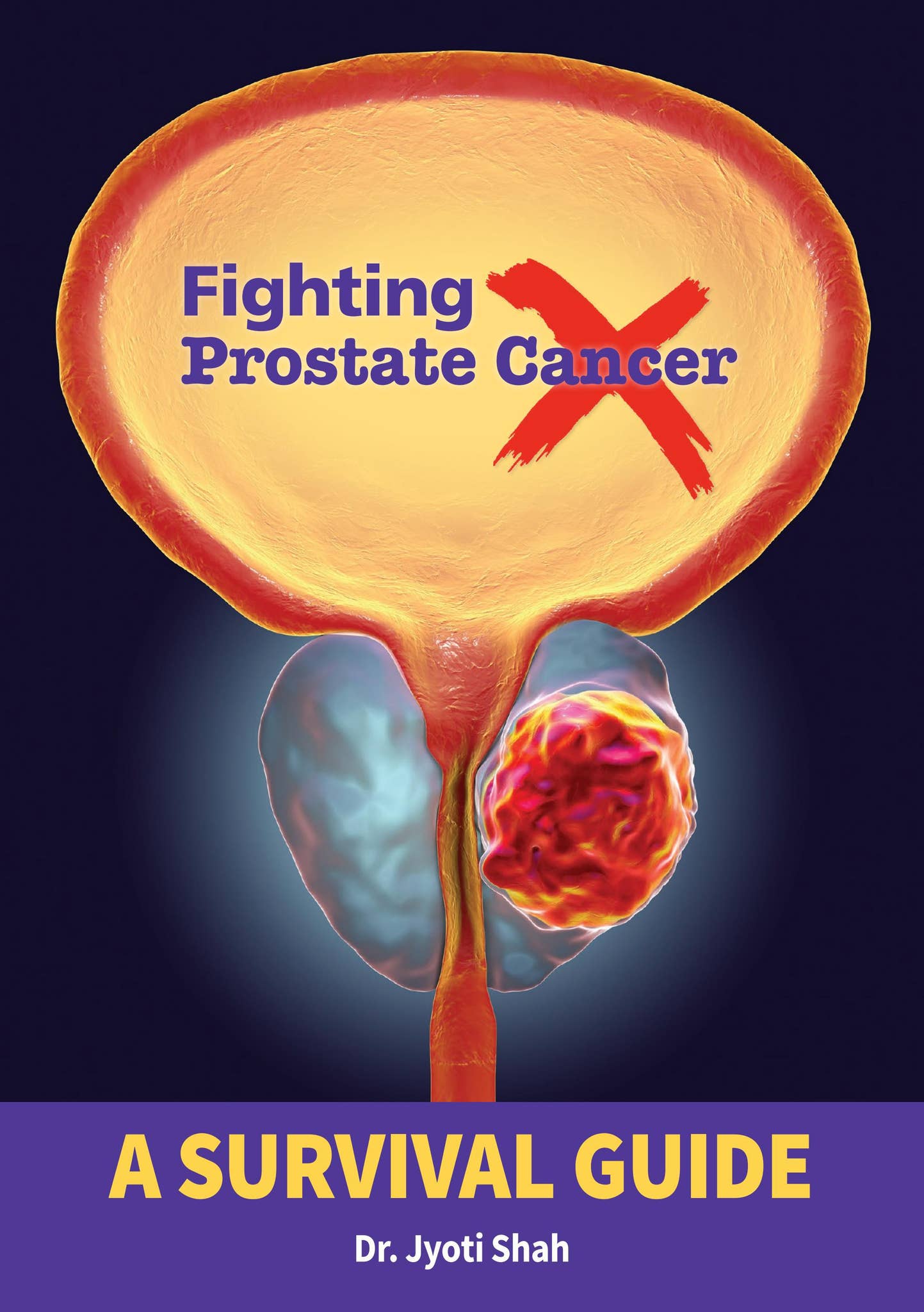 Fighting Prostate Cancer – A Survival Guide. Dr. Jyoti Shah by The ...