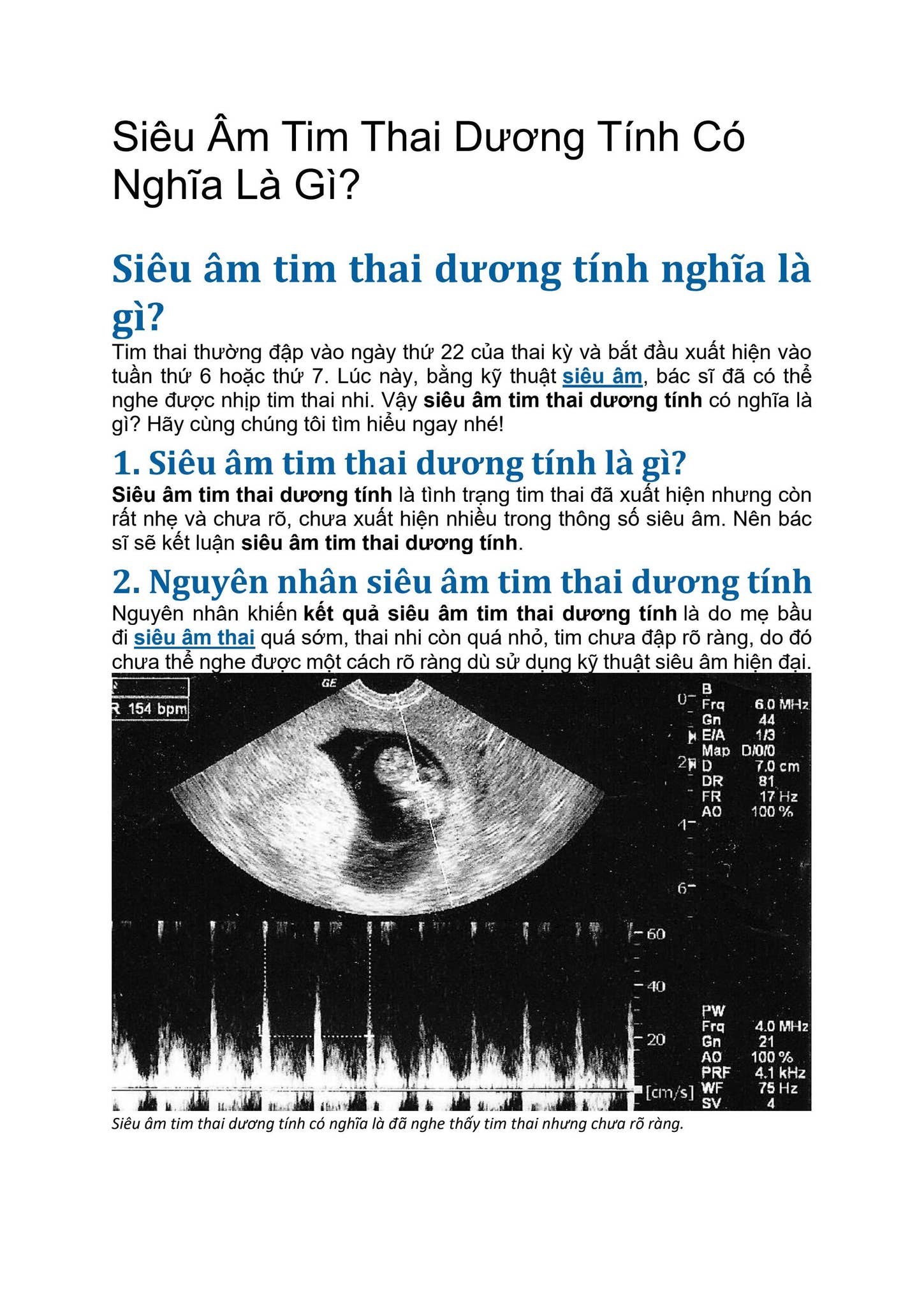 Siêu âm tim thai dương tính có nghĩa là gì? by phuongnam hospital - Issuu