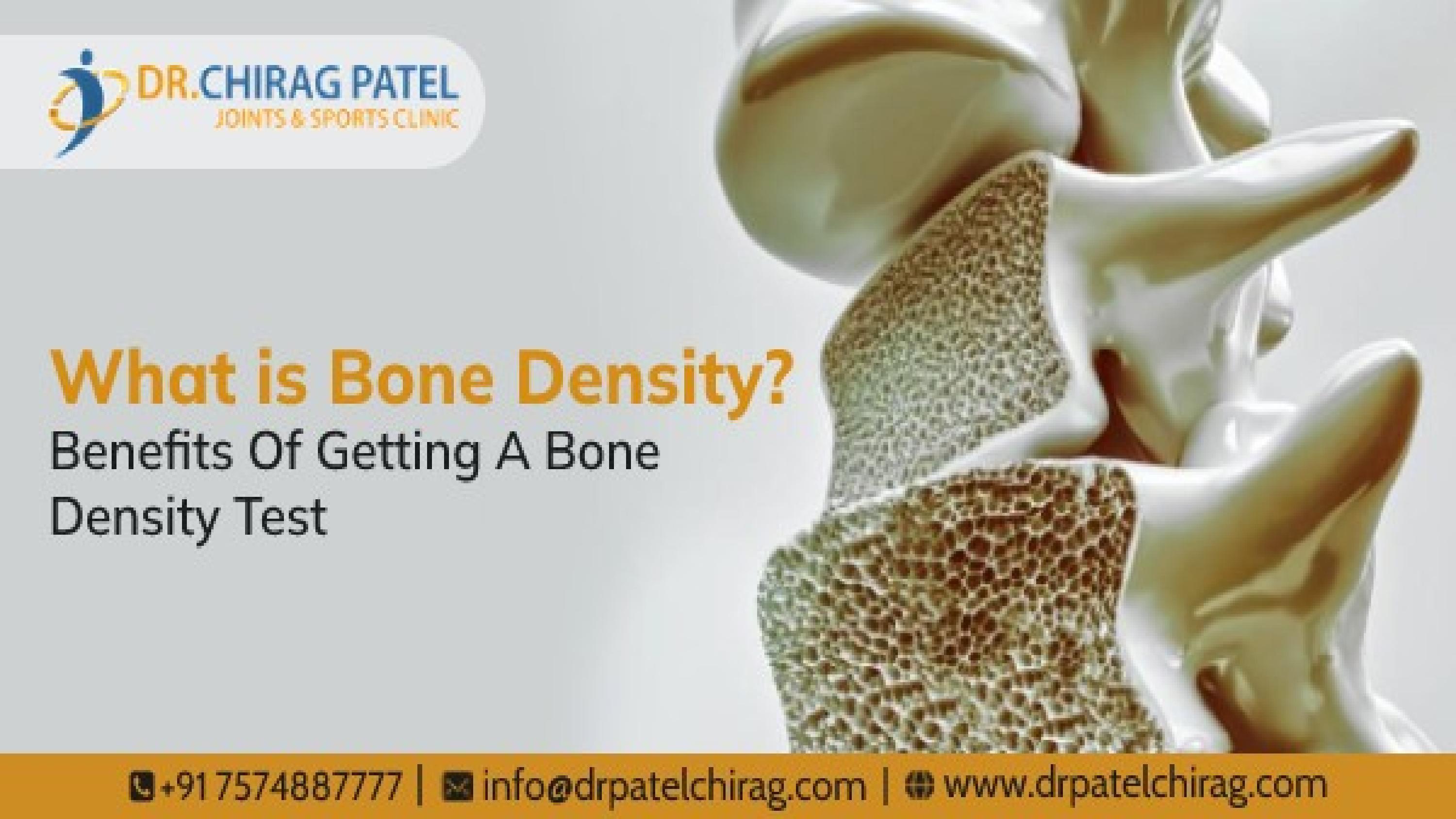 What is Bone Density? Benefits Of Getting A Bone Density Test by ...
