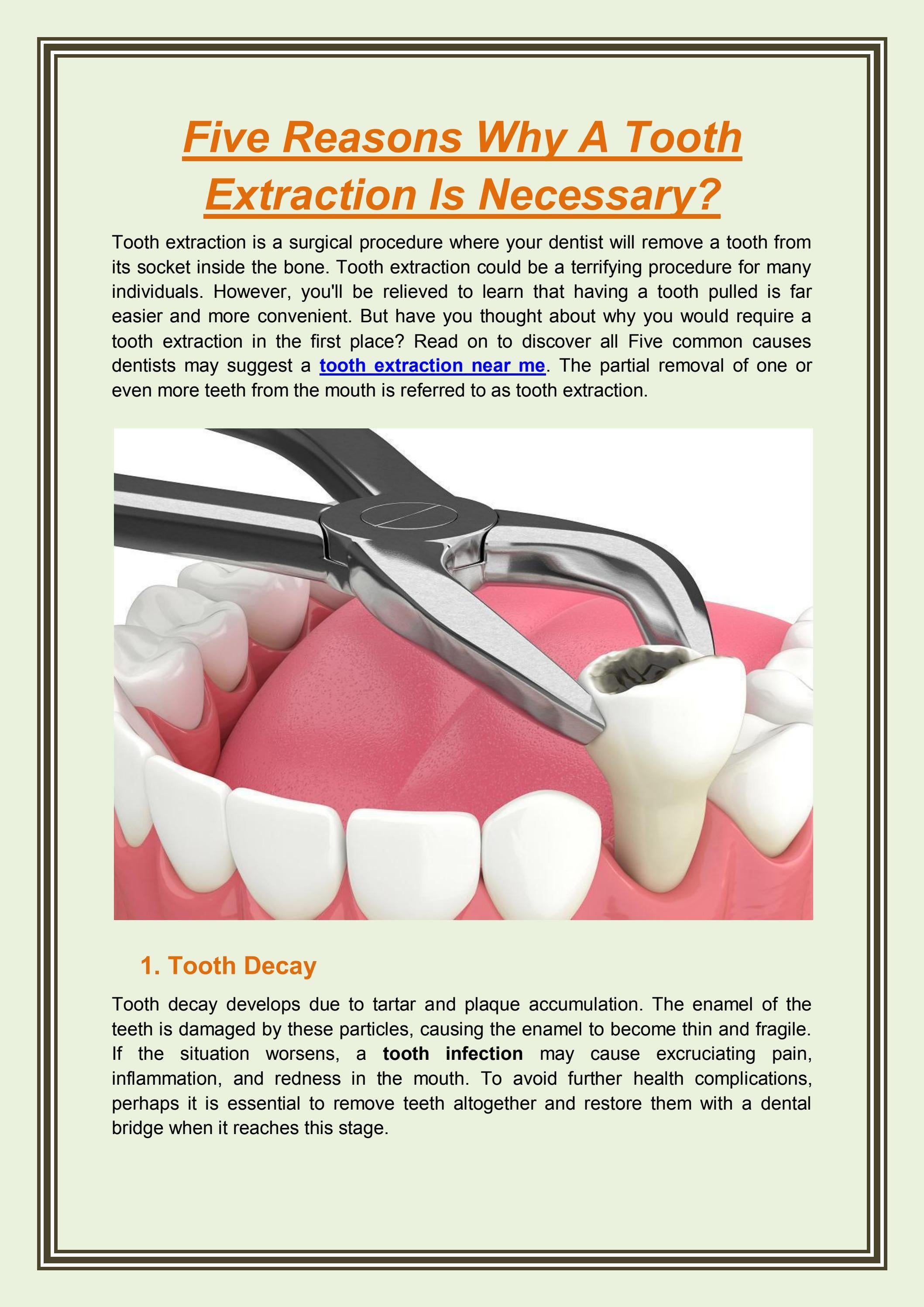 Five Reasons Why A Tooth Extraction Is Necessary? by Edge Dental - Issuu