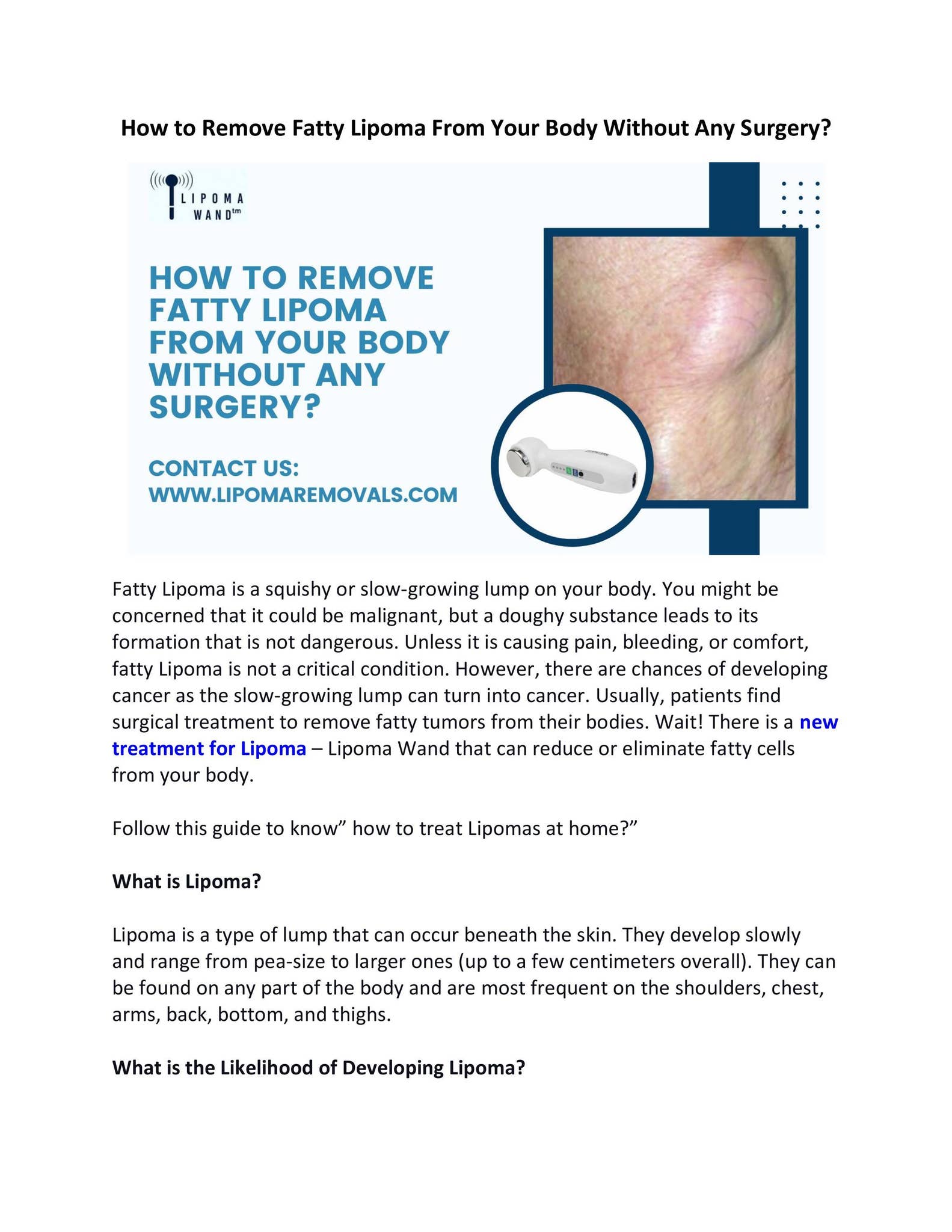 How to Remove Fatty Lipoma From Your Body Without Any Surgery? by ...