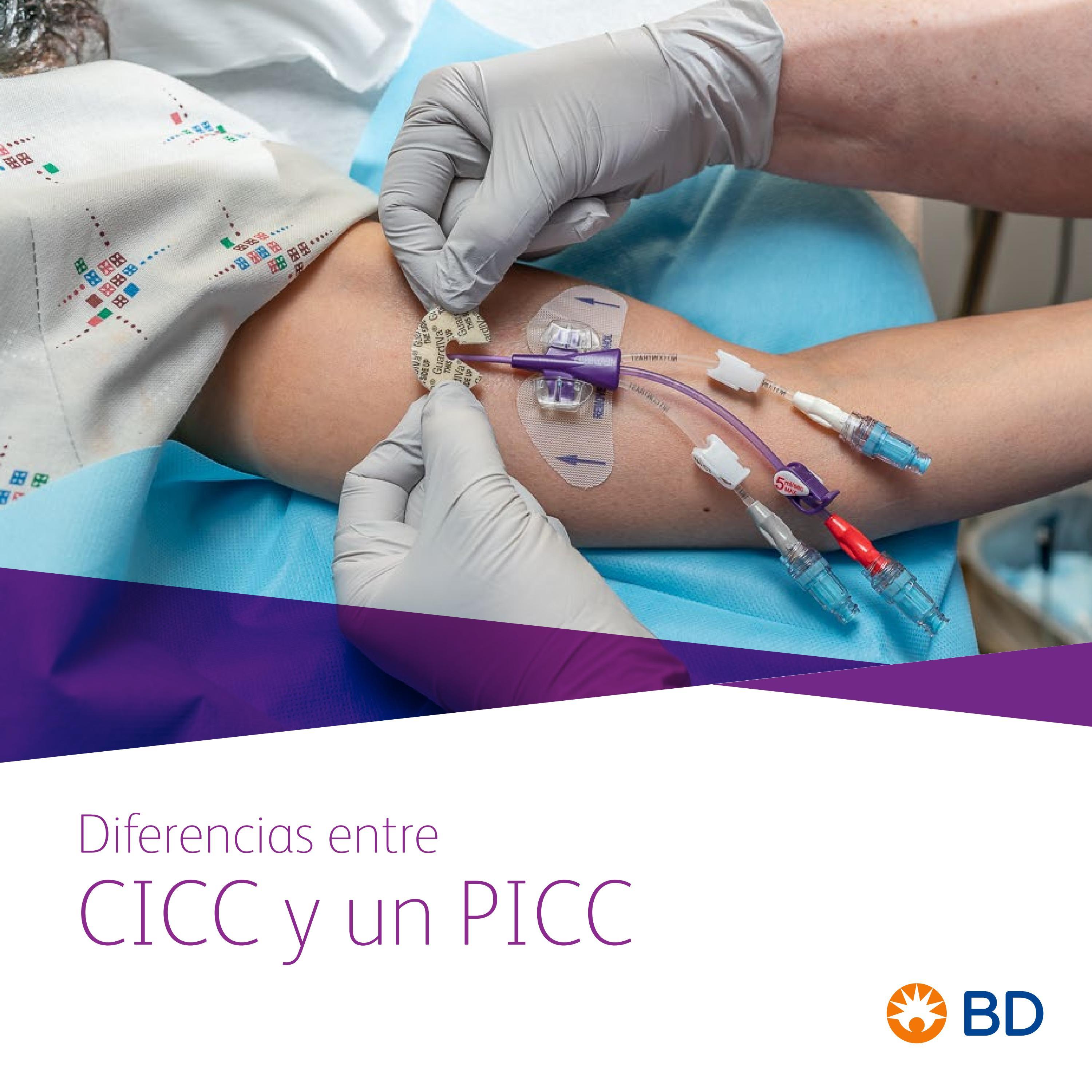 Diferencias entre un CICC y un PICC by sentidocomun.life - Issuu