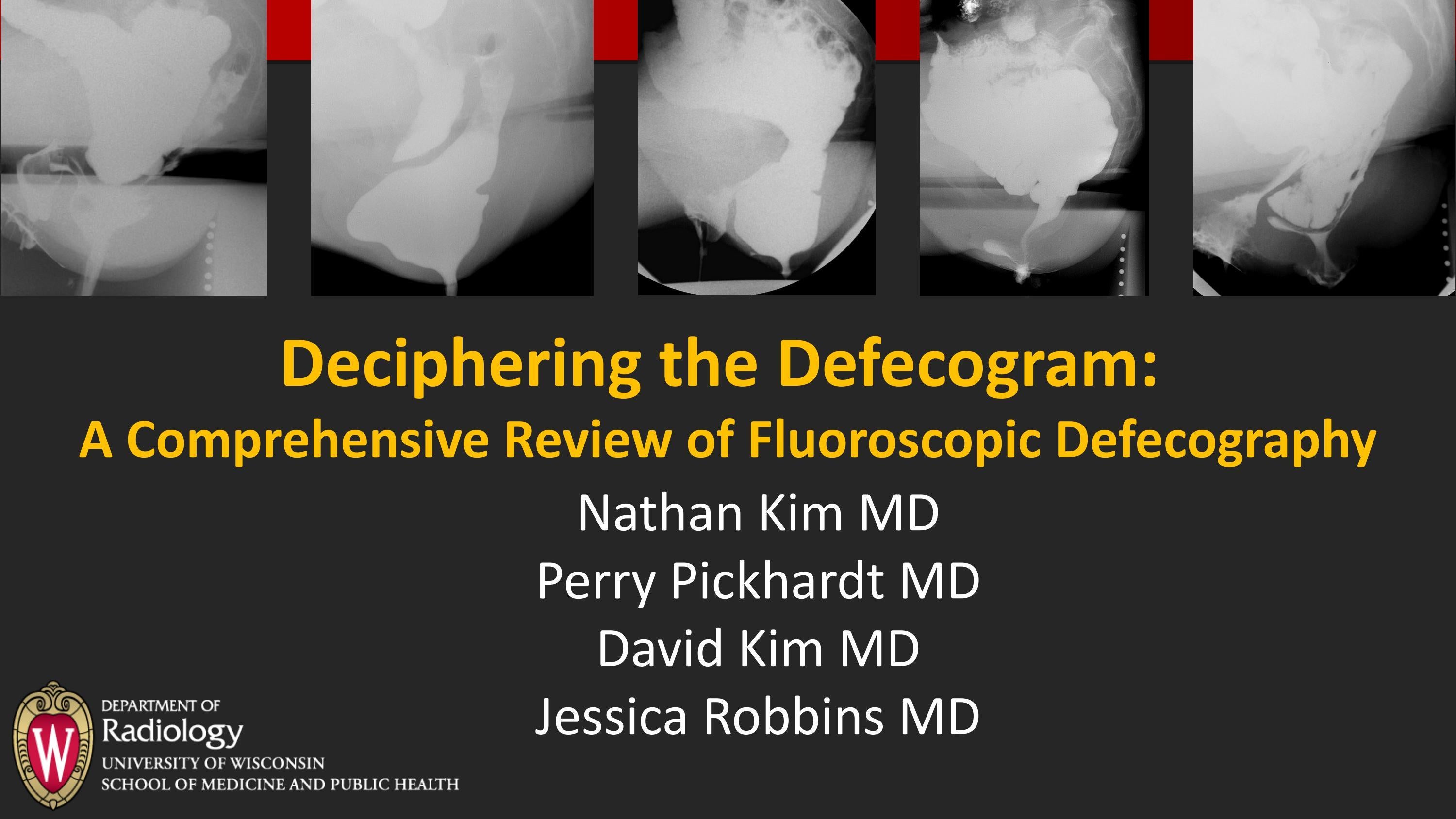 GI/GU 2: RSNA Defecography by uwiscradiology - Issuu