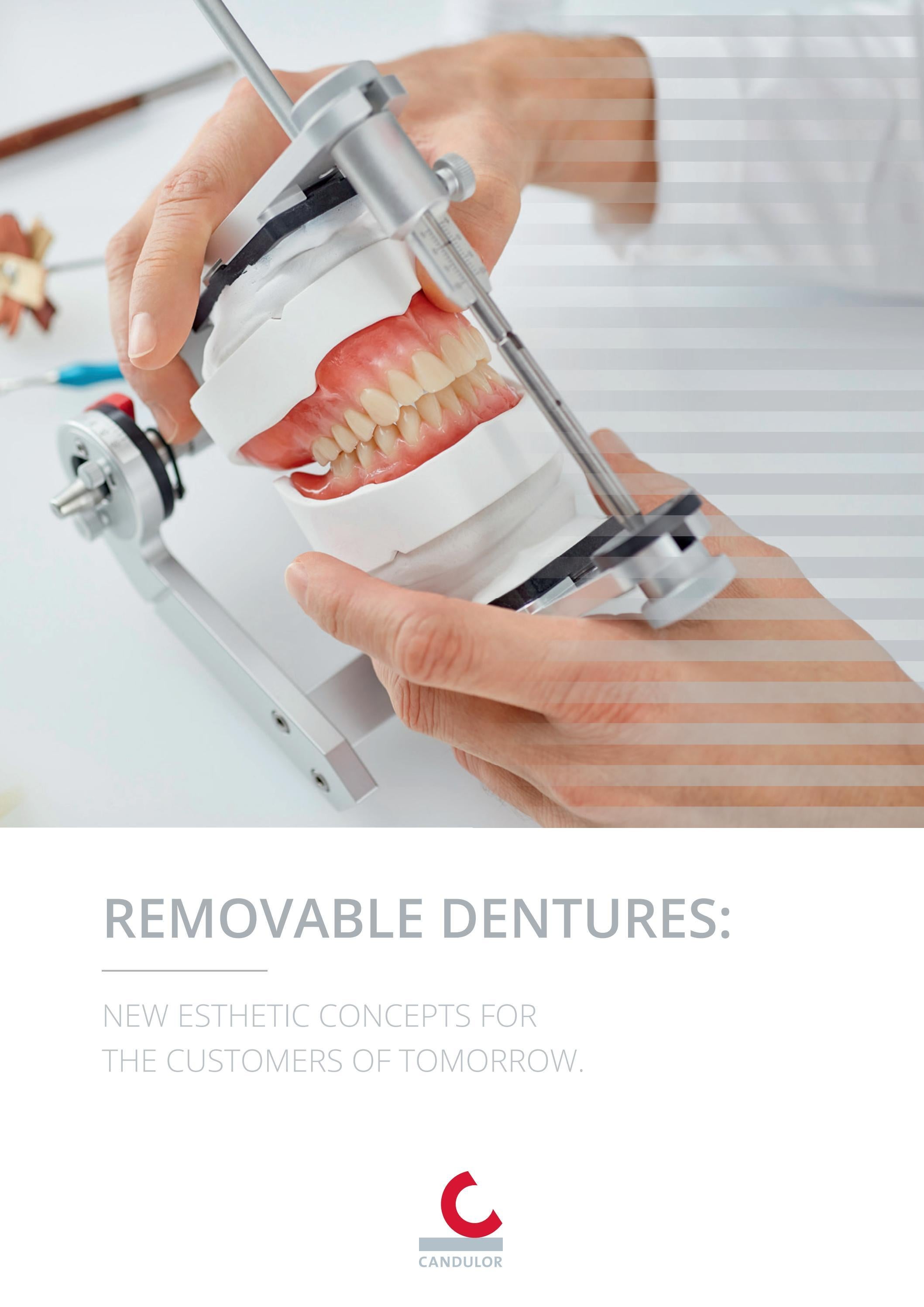 Removable dentures: New esthetic concepts for the customers of tomorrow ...