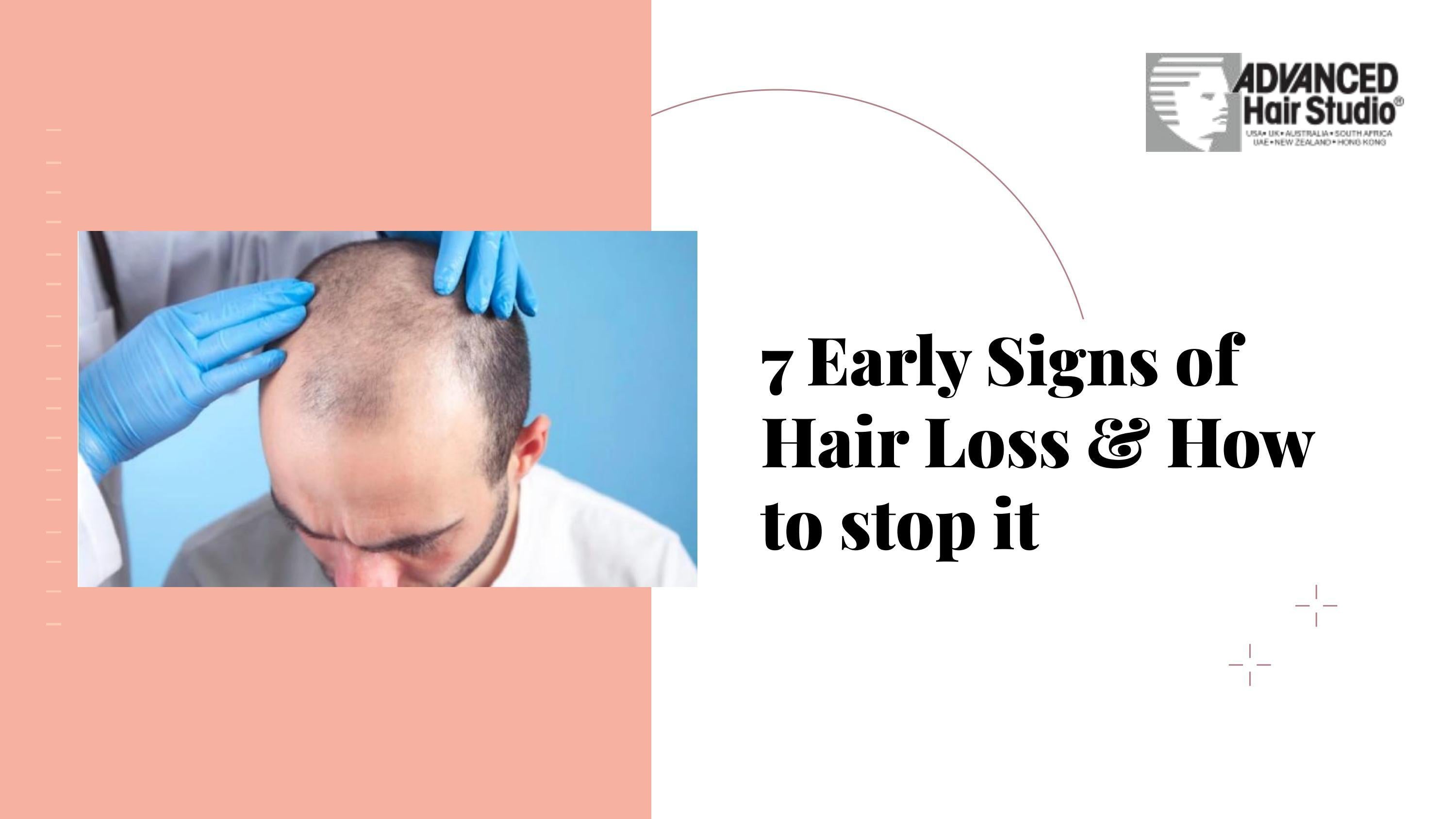 Early Hair Loss Signs & How To Prevent It - Advanced Hair Studio by ...