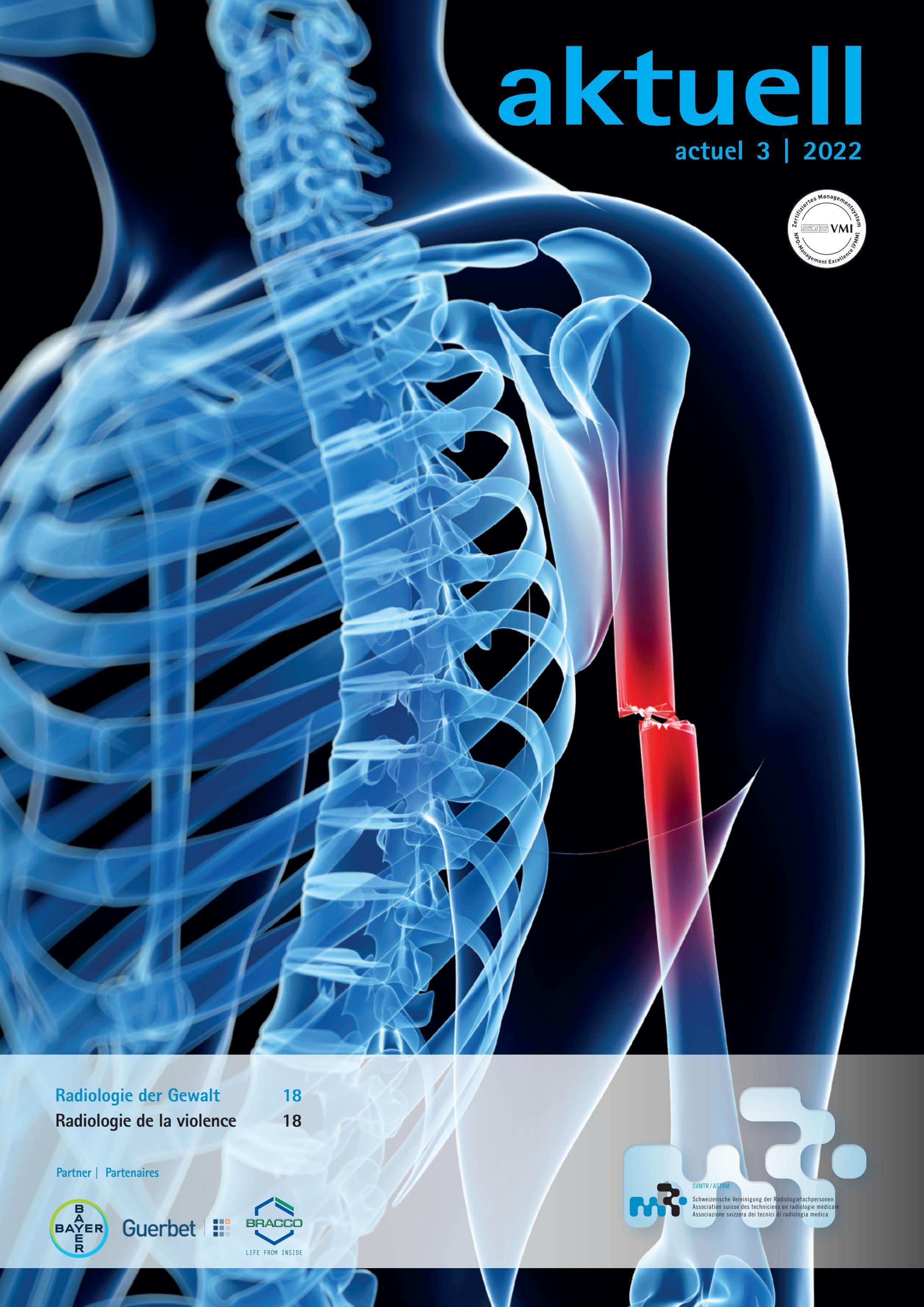 SVMTR Aktuell Juni 2022/ ASTRM actuel juin 2022 by Walker Management AG ...