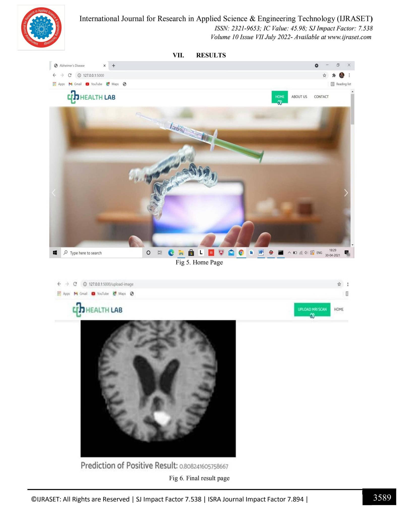 Detection of Alzheimer’s Disease from MRI scan using Machine Learning ...