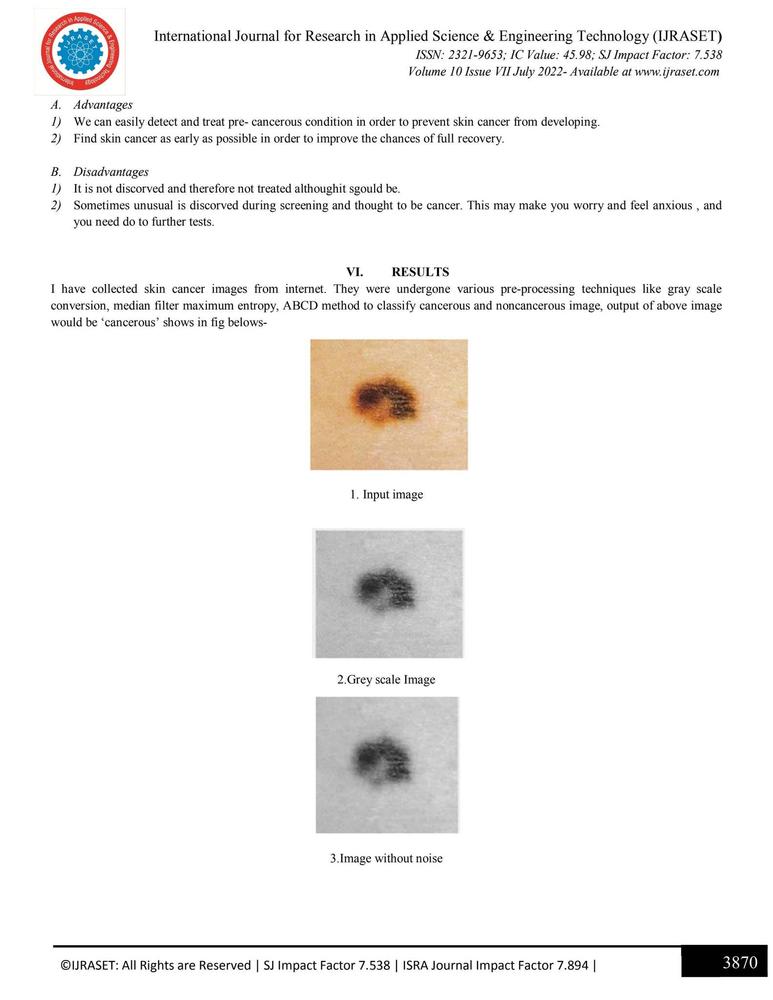 Skin Cancer Detection Using Image Processing by IJRASET - Issuu