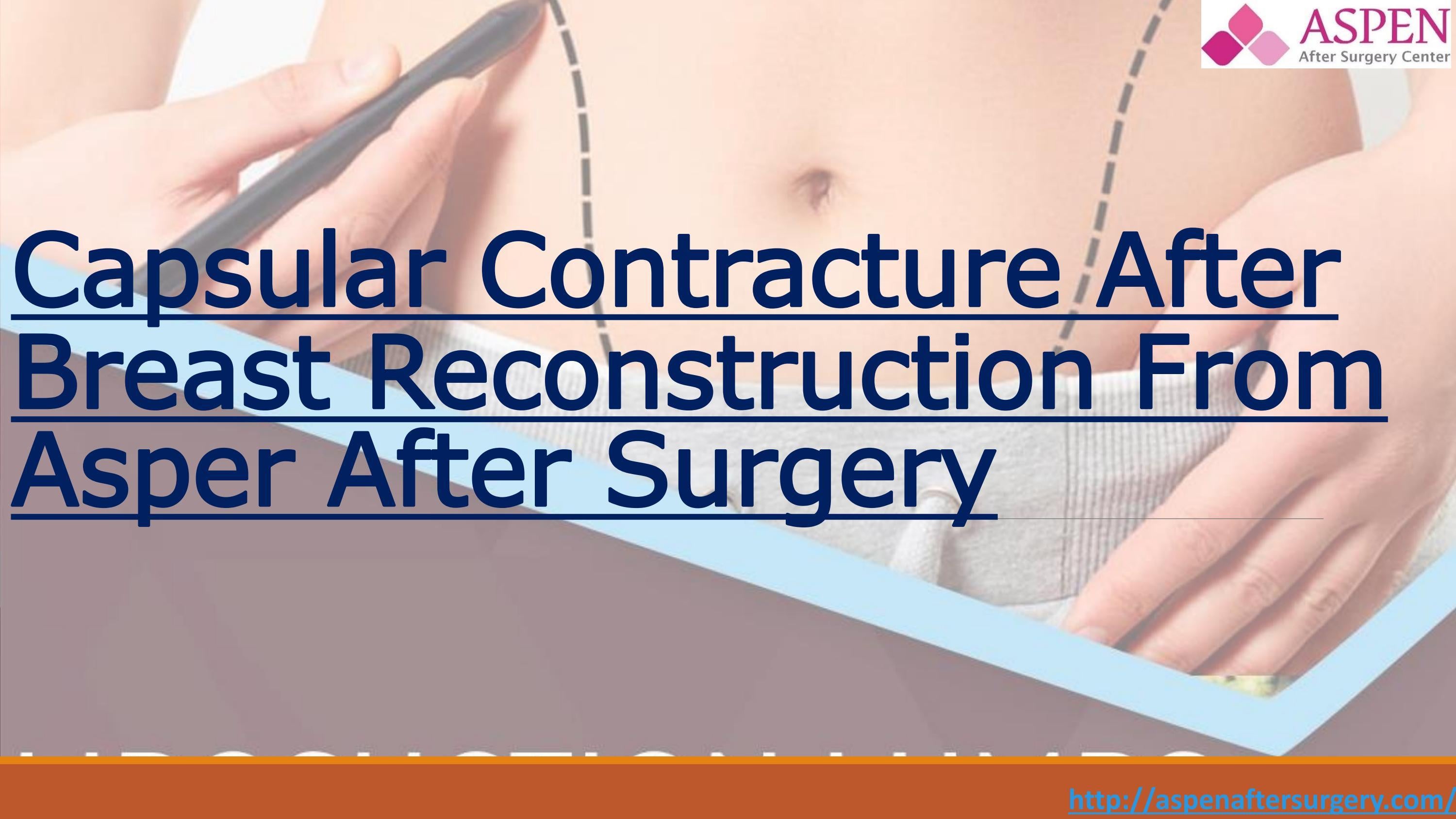 Capsular Contracture After Breast Reconstruction From Asper After