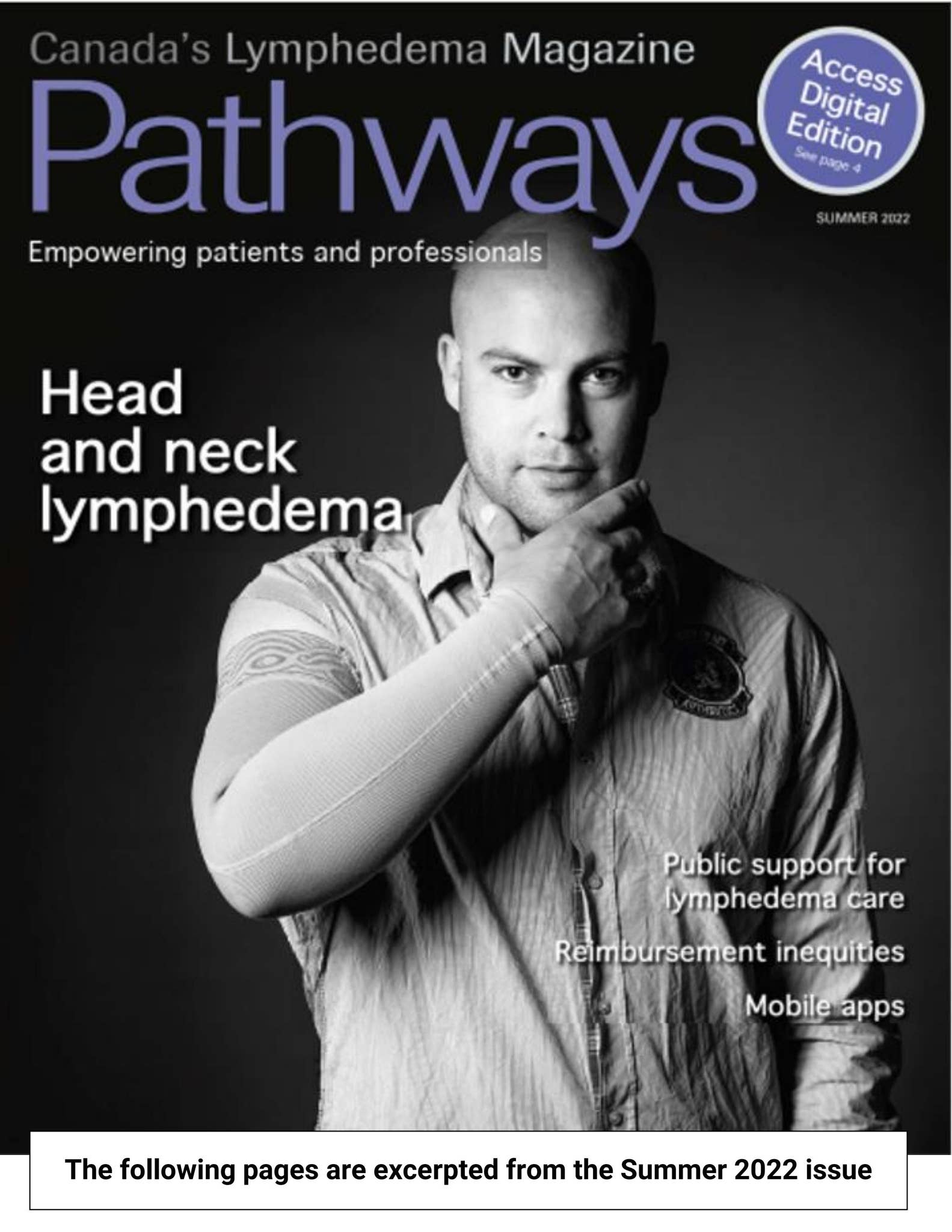 Lymphedema Funding Inequities in Canada. Summer 2022 Pathways. by Canadian Lymphedema Framework ...