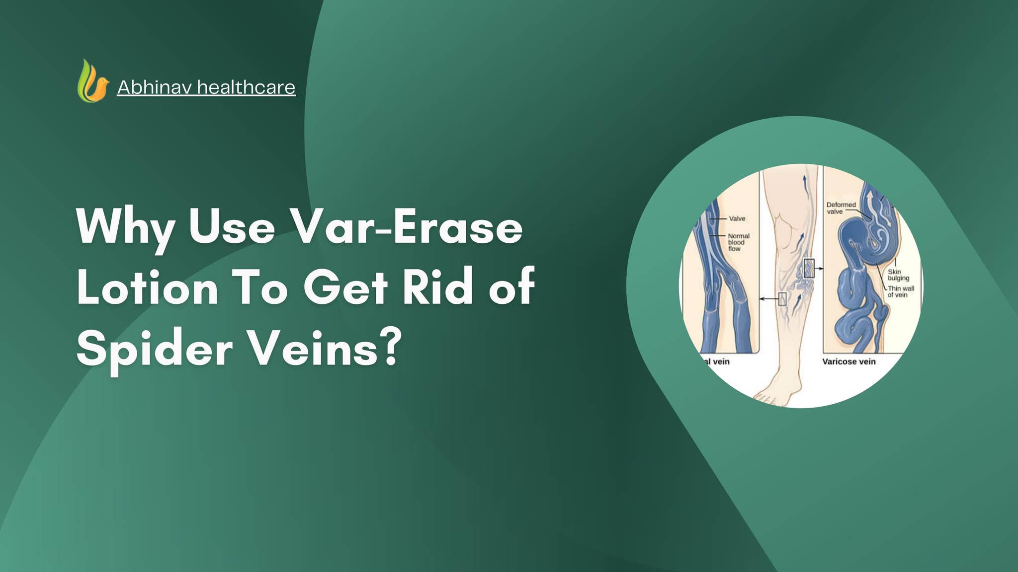 PTFE Gaskets with TFMTM Inner Eyelet & Pre-comp. edge by abhinav ...