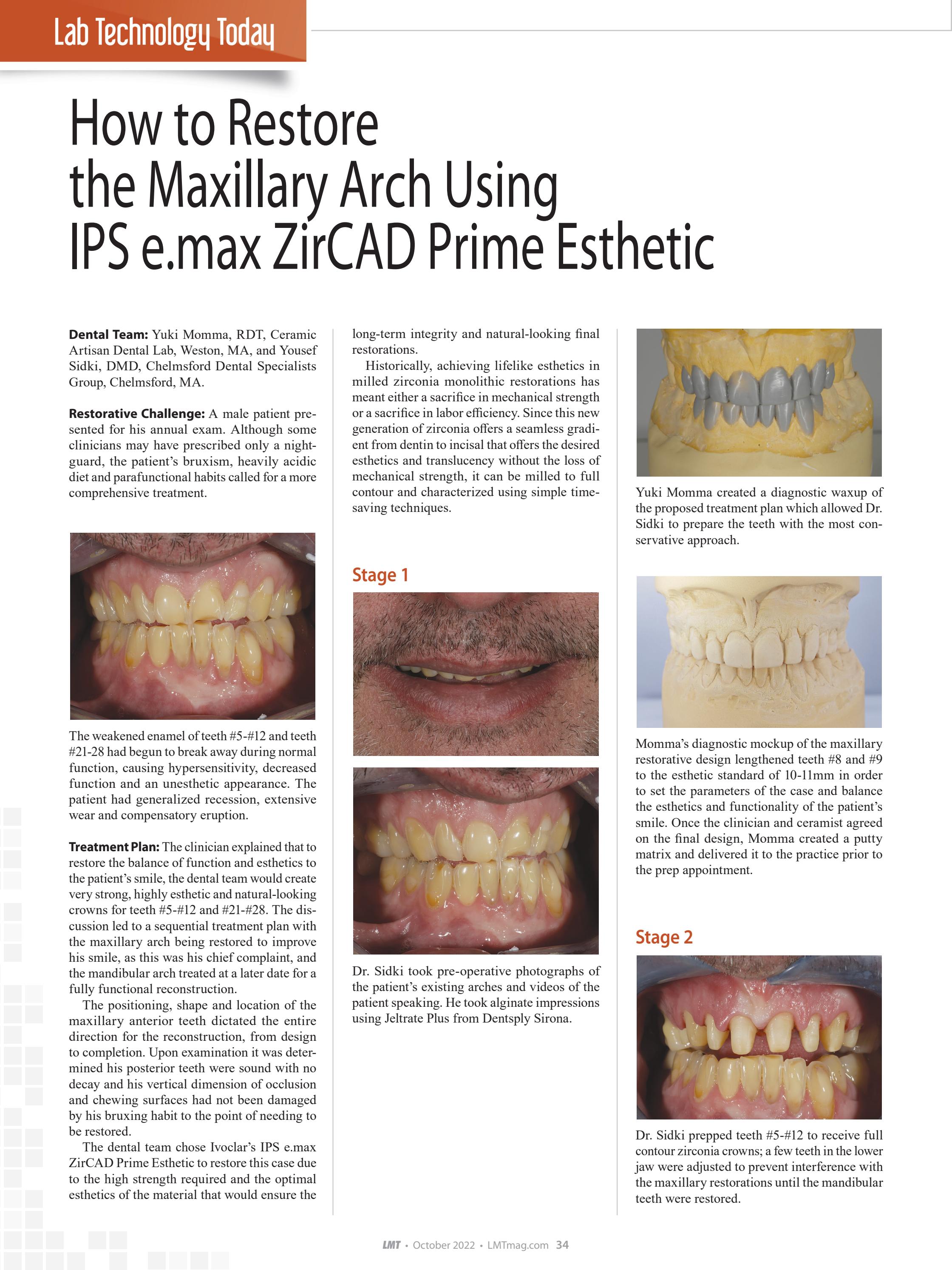 Dr Yuki Momma - How to Restore the Maxillary Arch Using IPS e.max ...