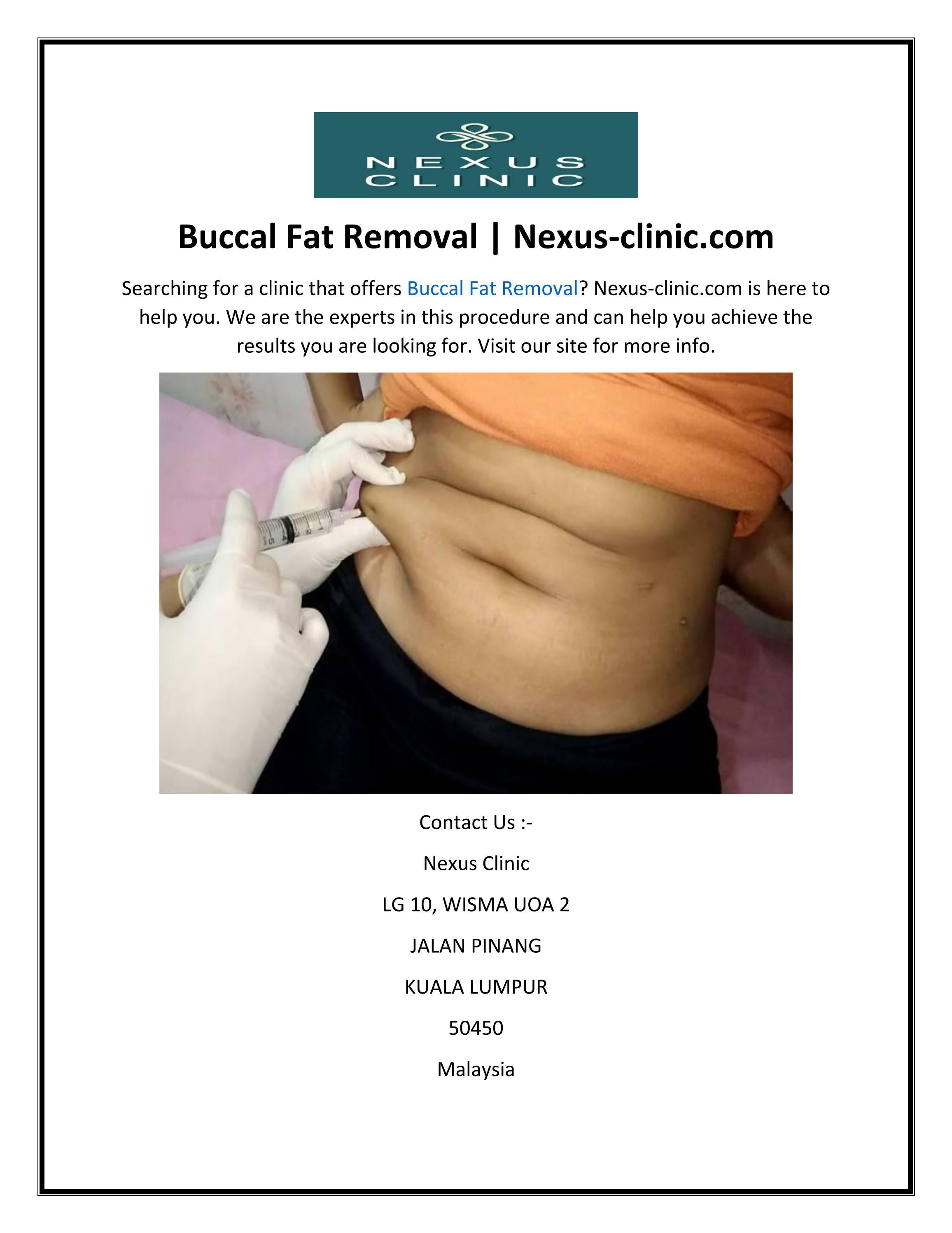 Buccal Fat Removal | Nexus-clinic.com by Nexus Clinic - Issuu