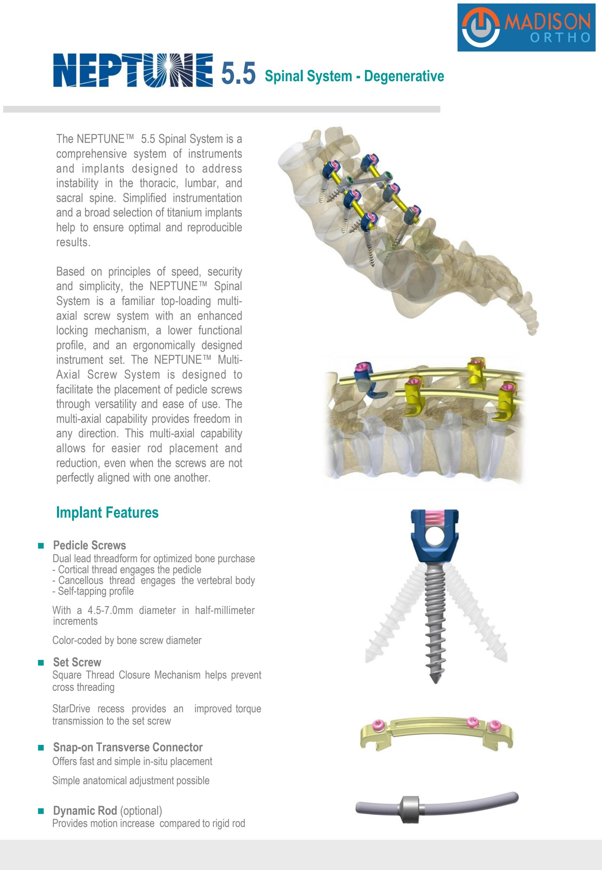 Spinal System - Degenerative - Madison Ortho by andrewrodrigues110822 ...