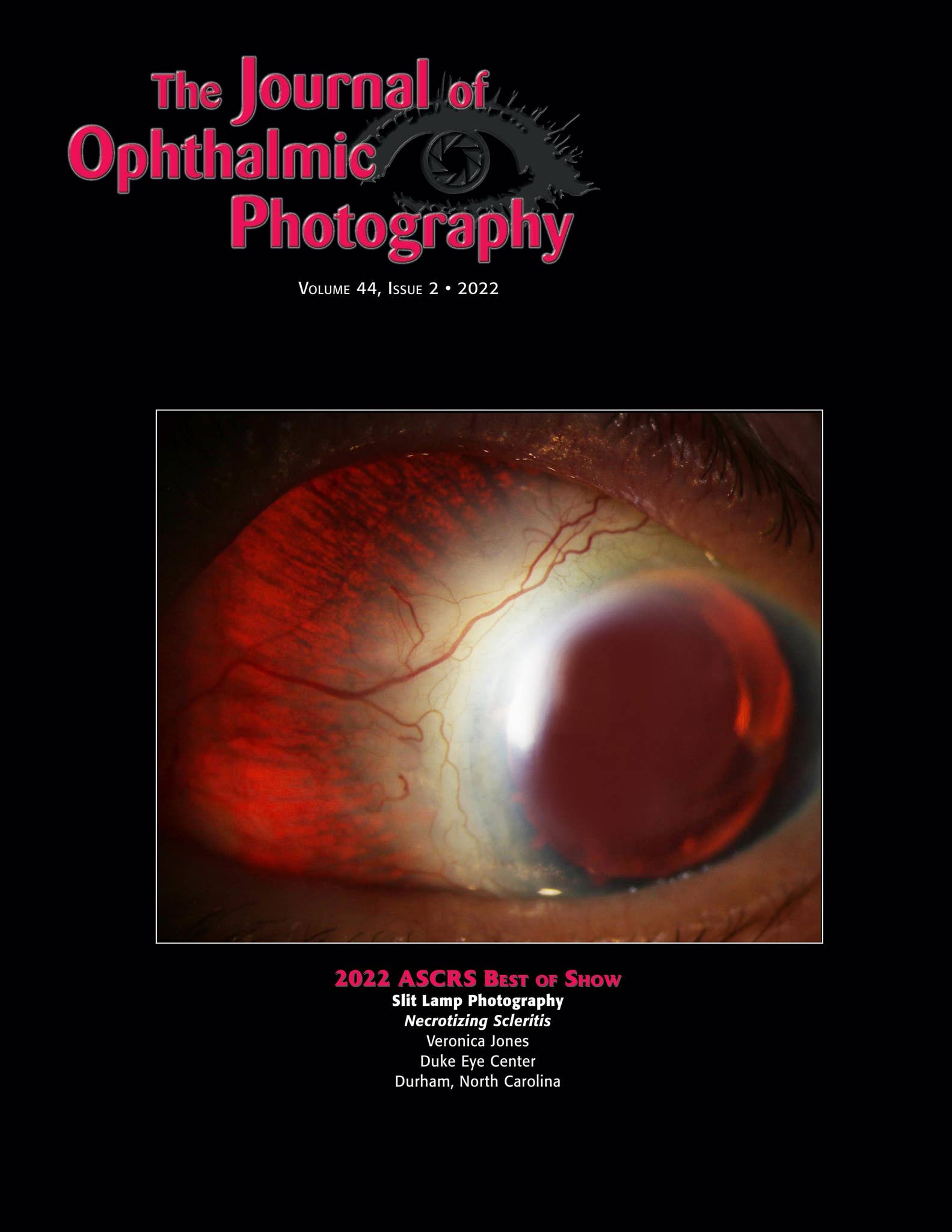The Journal of Ophthalmic Photography Volume 44 Issue 2 2022 by ...