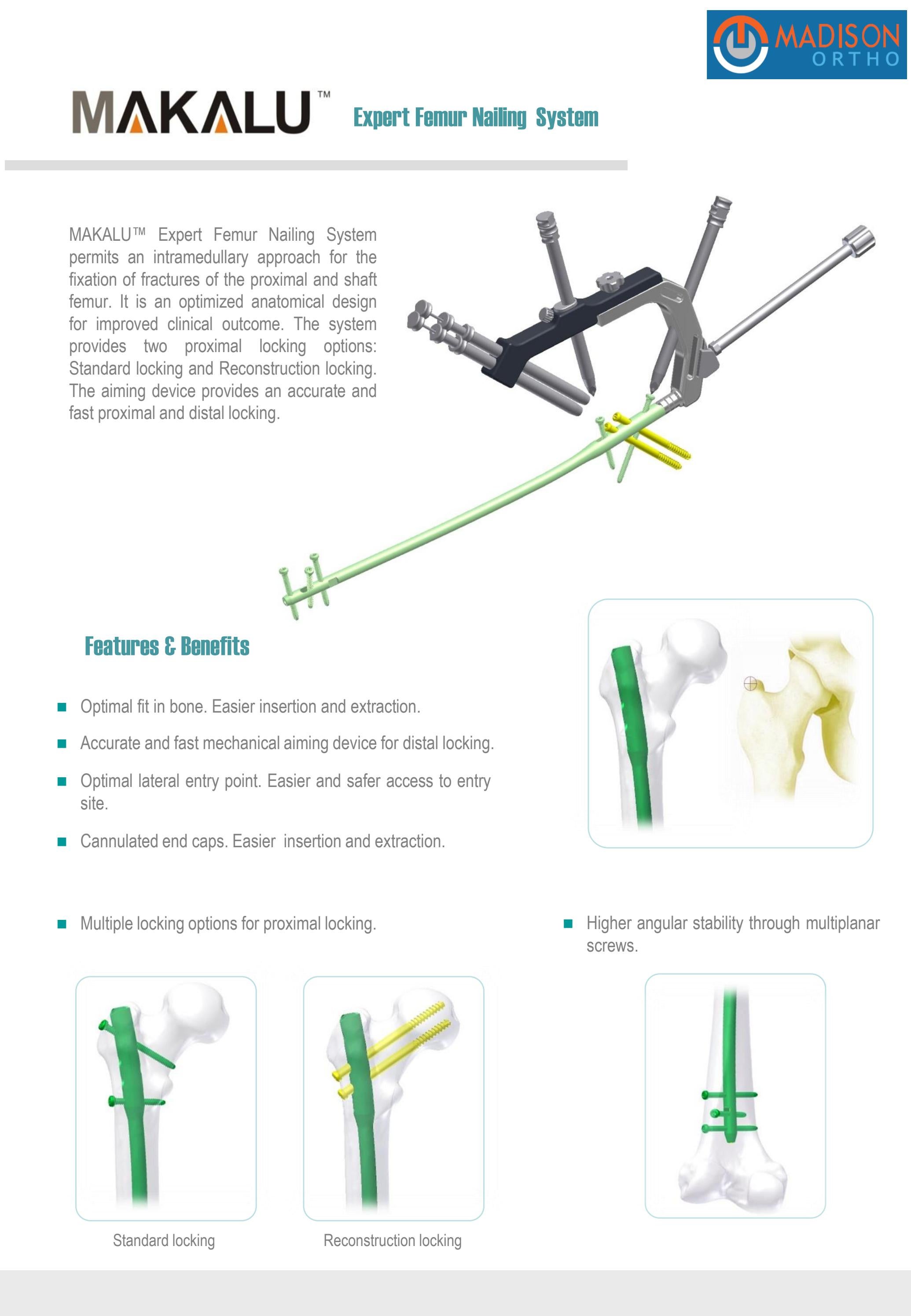 Expert Femur Nailing System - Madison Ortho by andrewrodrigues110822 ...