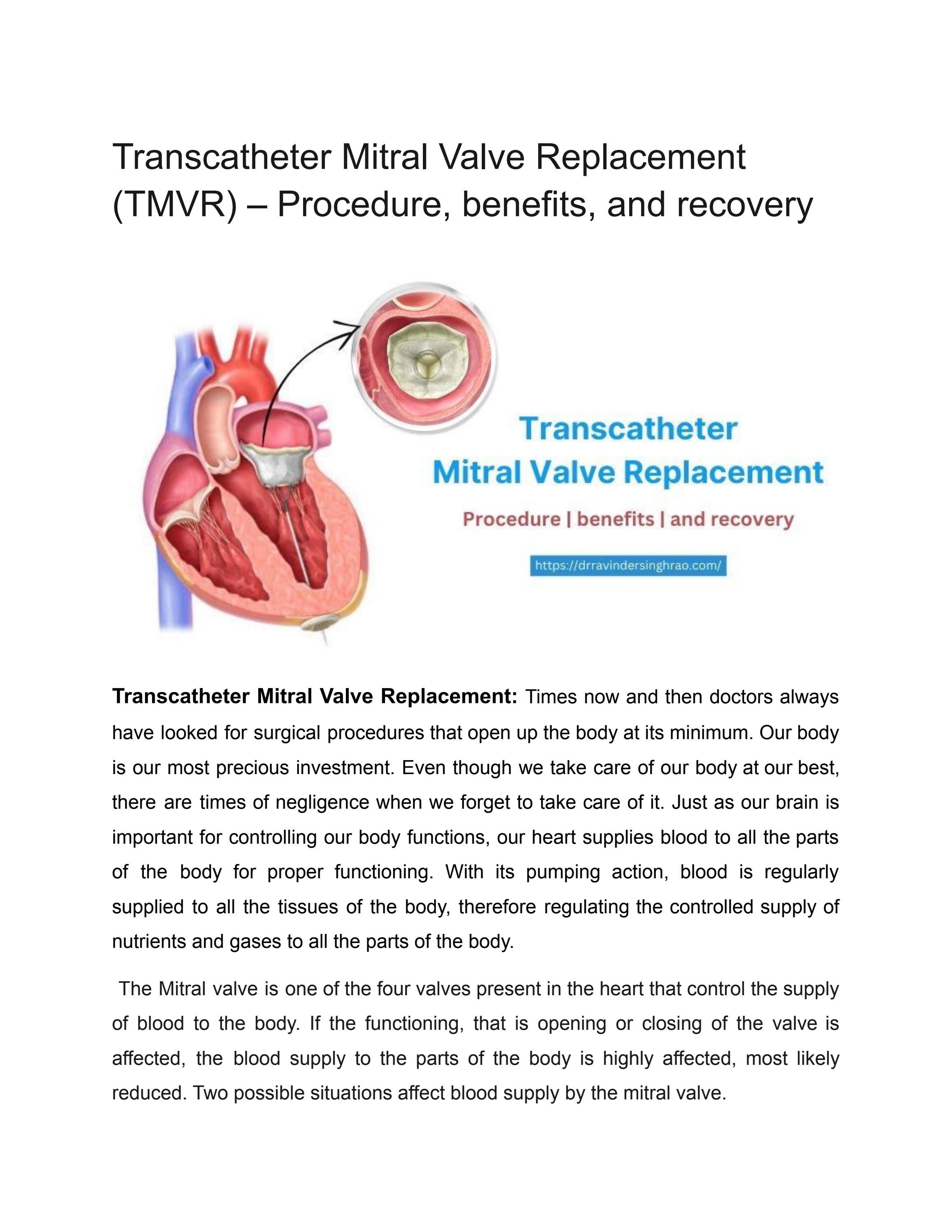 Best Doctor of Transcatheter Mitral Valve Replacement in India - Dr ...