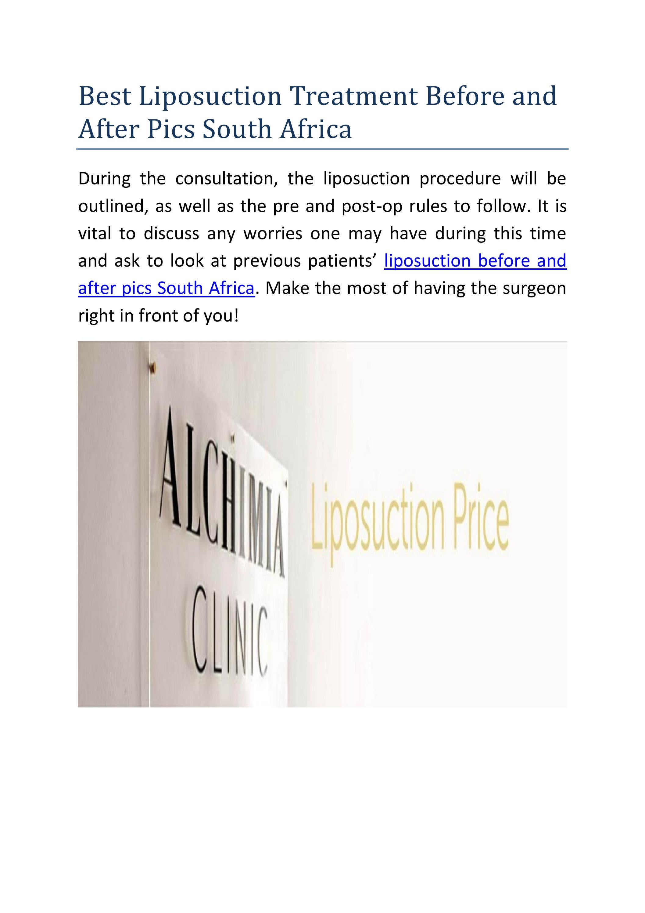 Best Liposuction Treatment Before and After Pics South Africa by ...