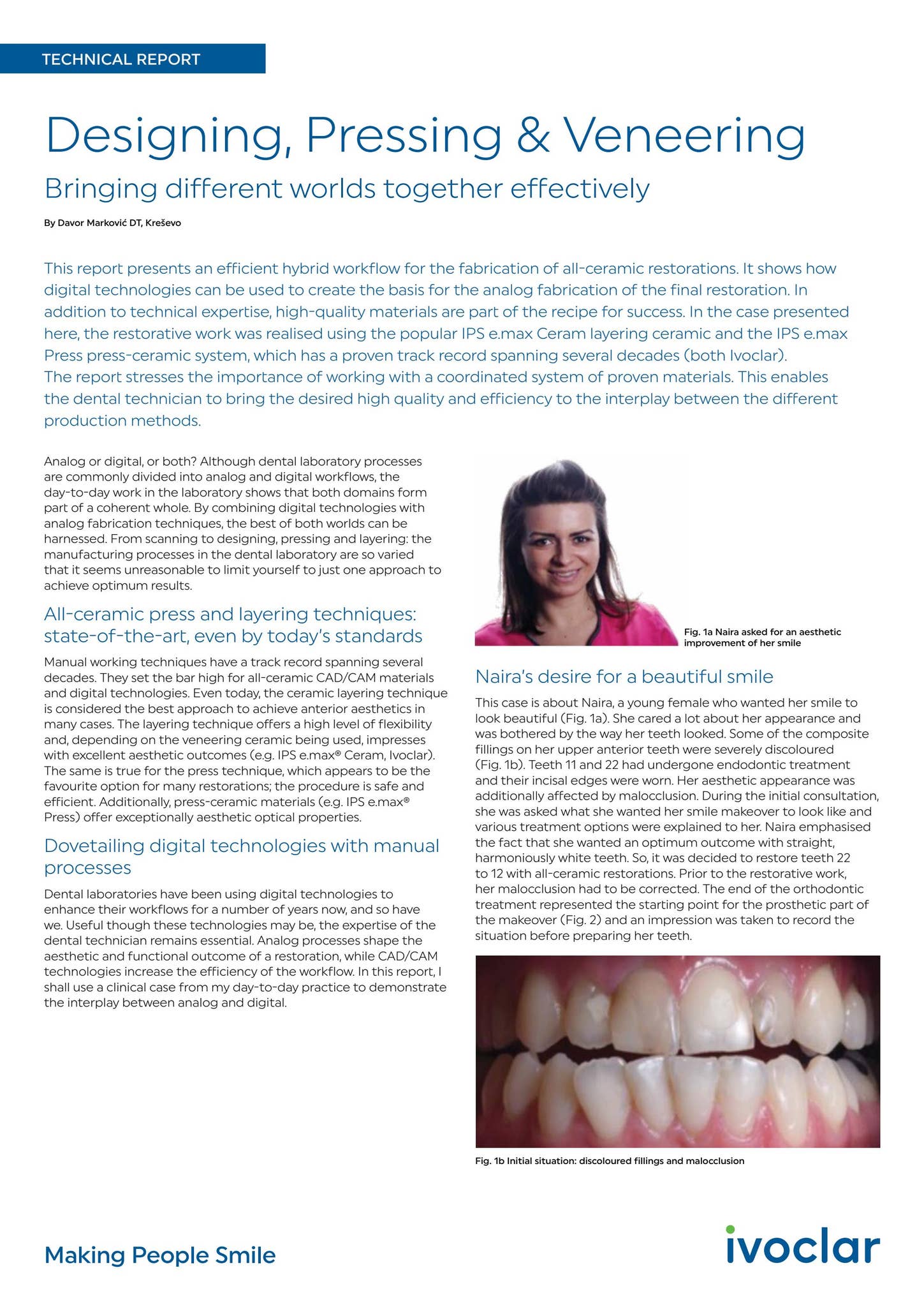 Designing pressing veneering Article by Davor Marković DT, Kreševo by ...