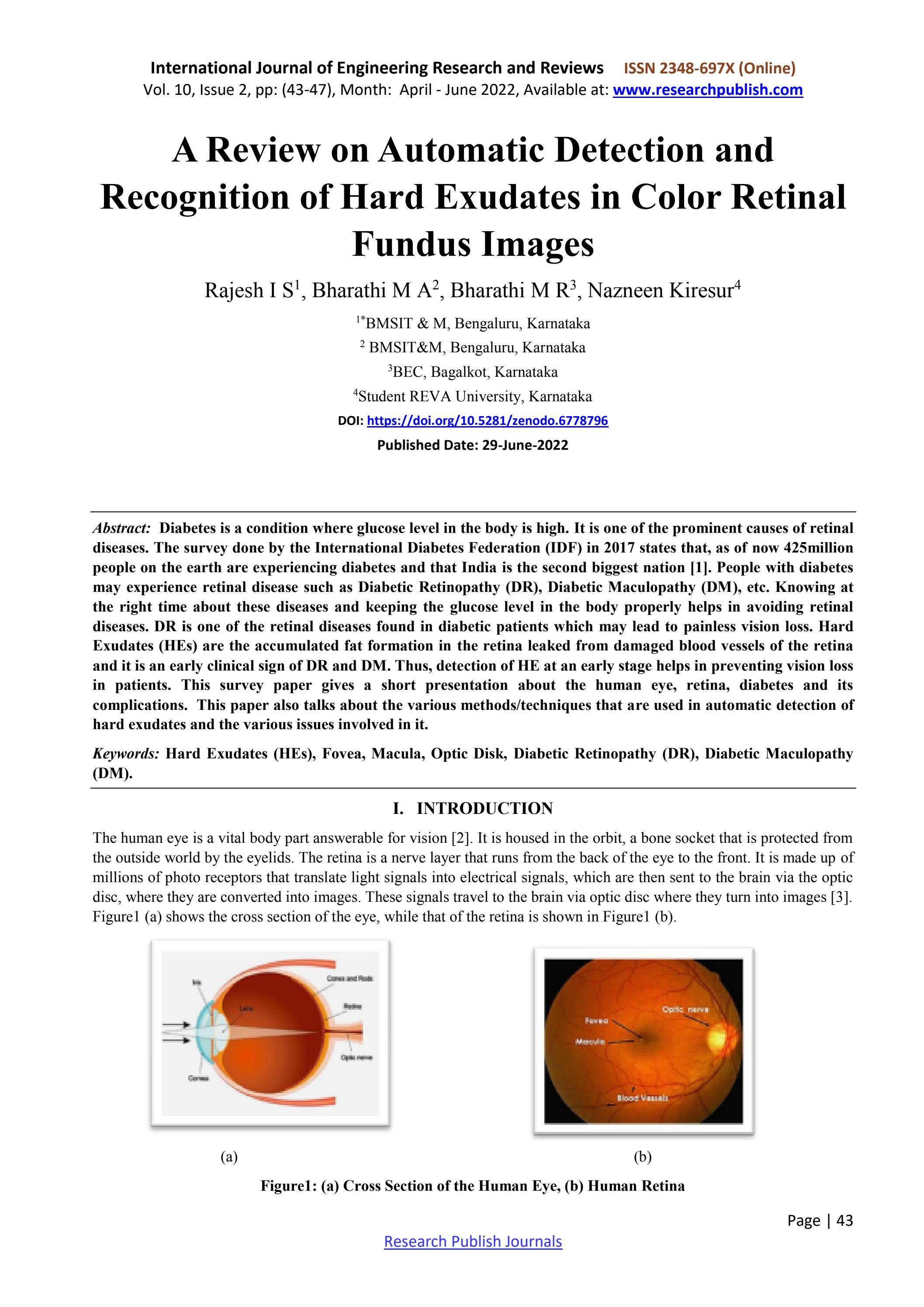 A Review On Automatic Detection And Recognition Of Hard Exudates In Color Retinal Fundus Images