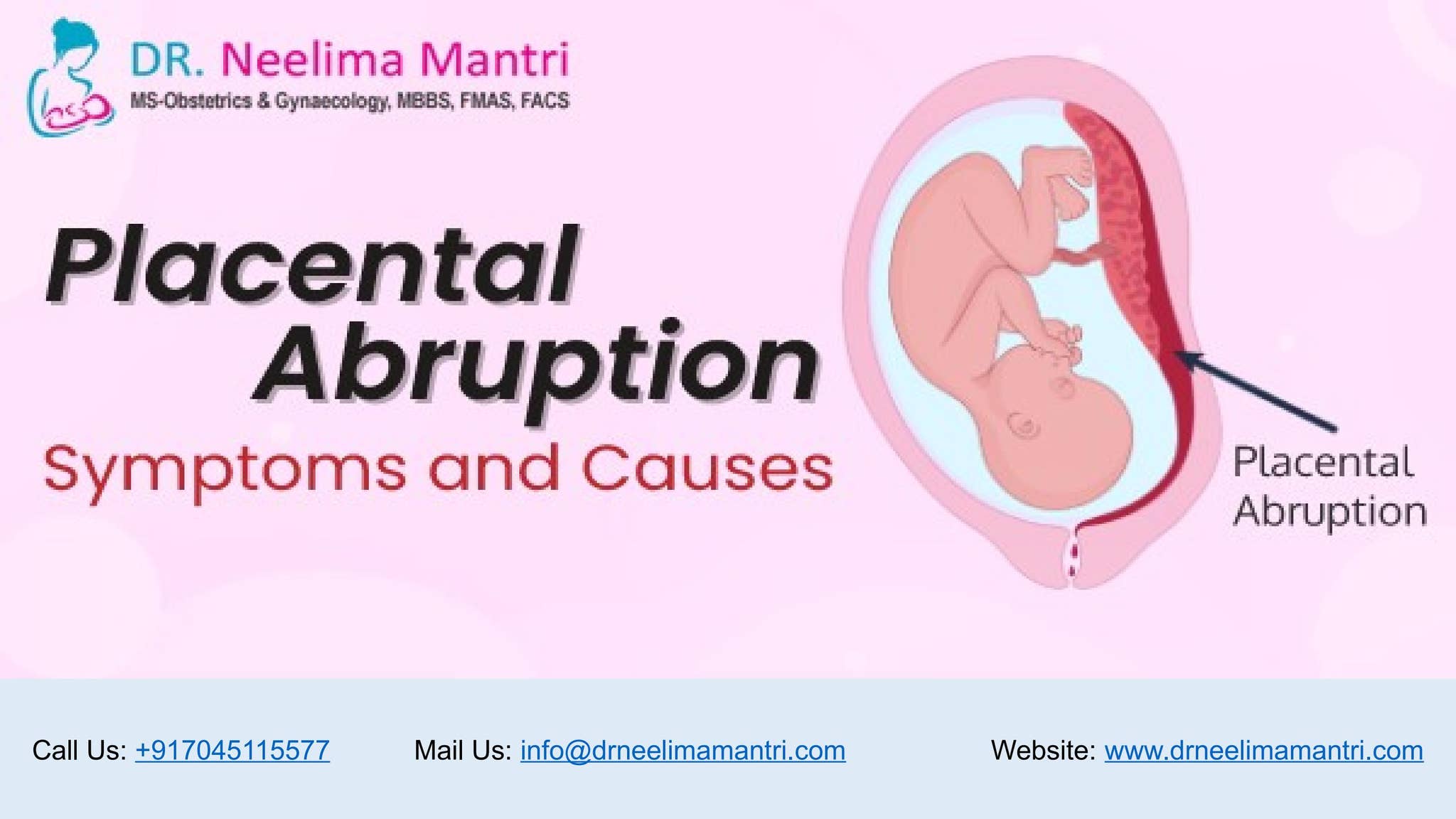 Placental Abruption Symptoms Causes & Treatment - Dr Neelima Mantri by ...