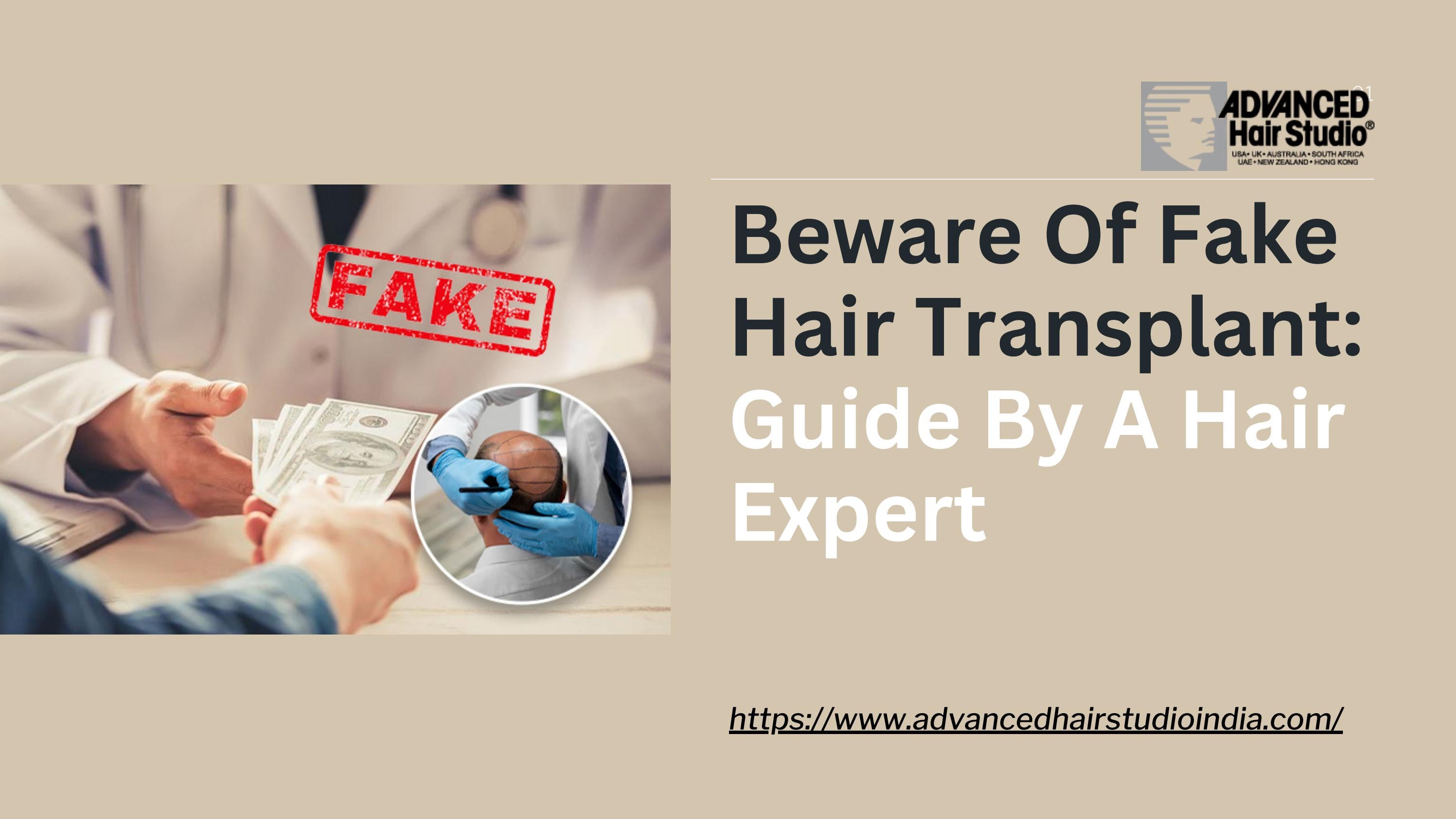 Beware Of Fake Hair Transplant: Guide By A Hair Expert by Advanced Hair ...