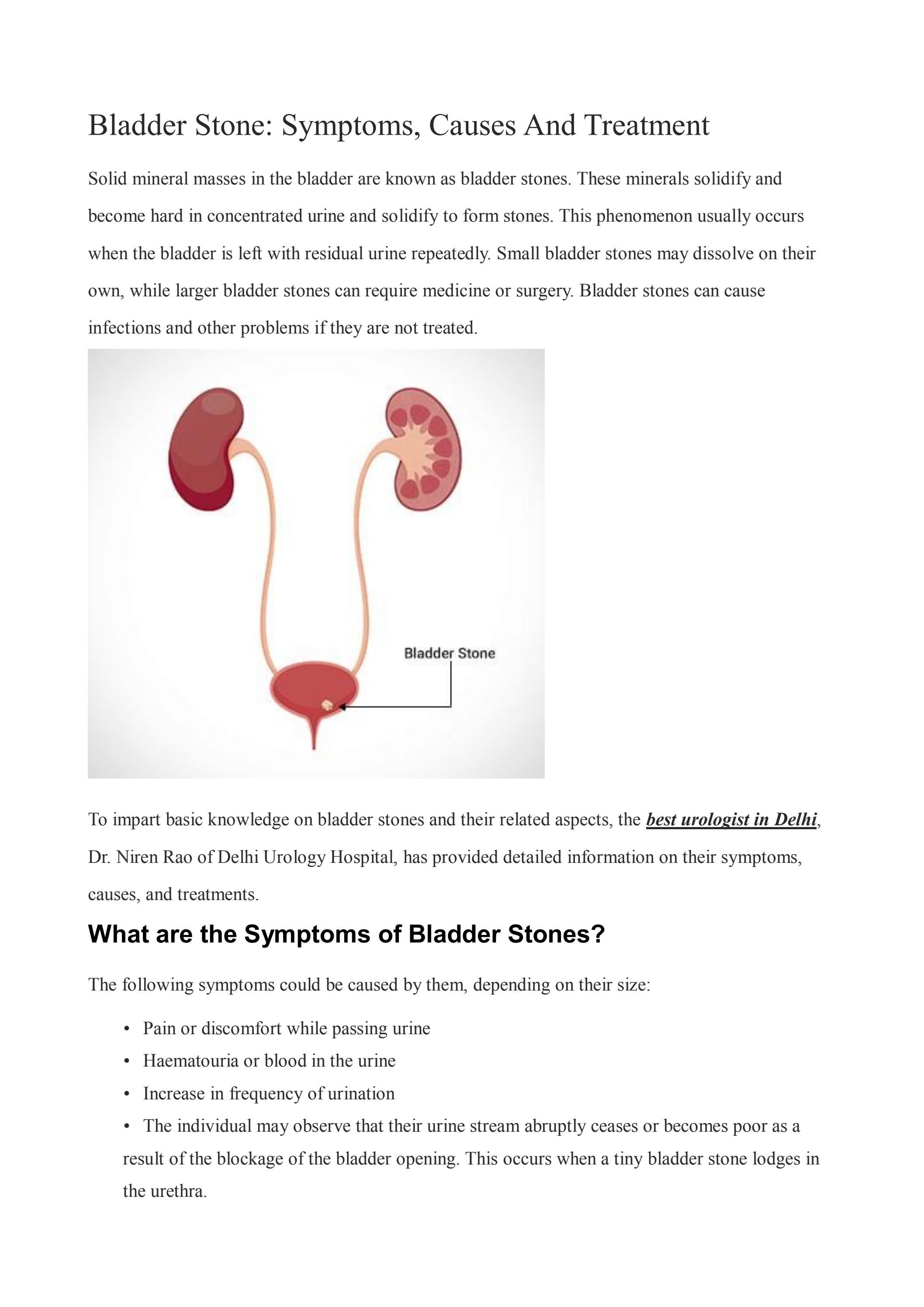 Bladder Stone: Symptoms, Causes And Treatment by delhiurologyhospital1 ...
