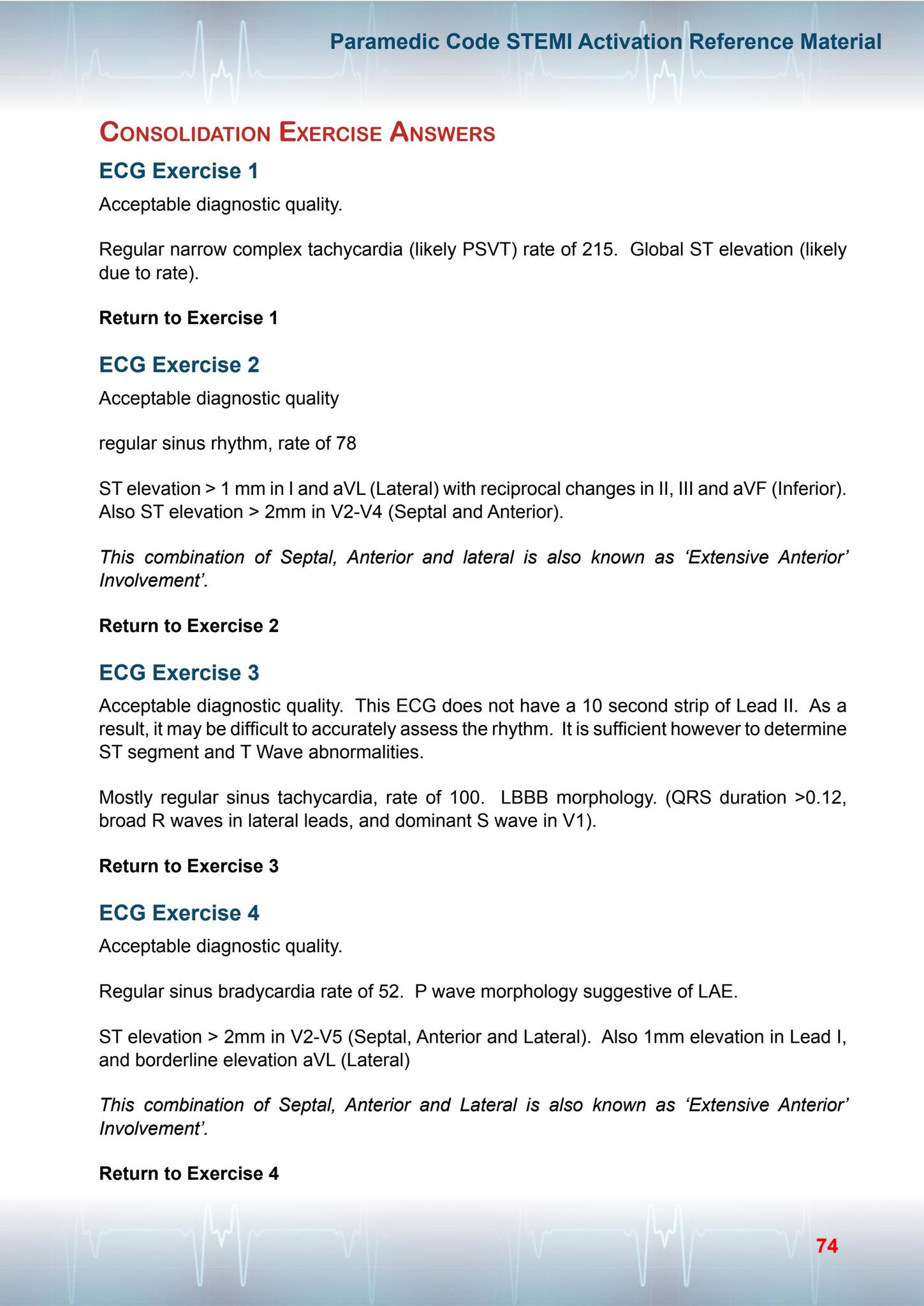 Code STEMI Activation for Paramedics V1.1 for eLearn 2023 by Clinical ...