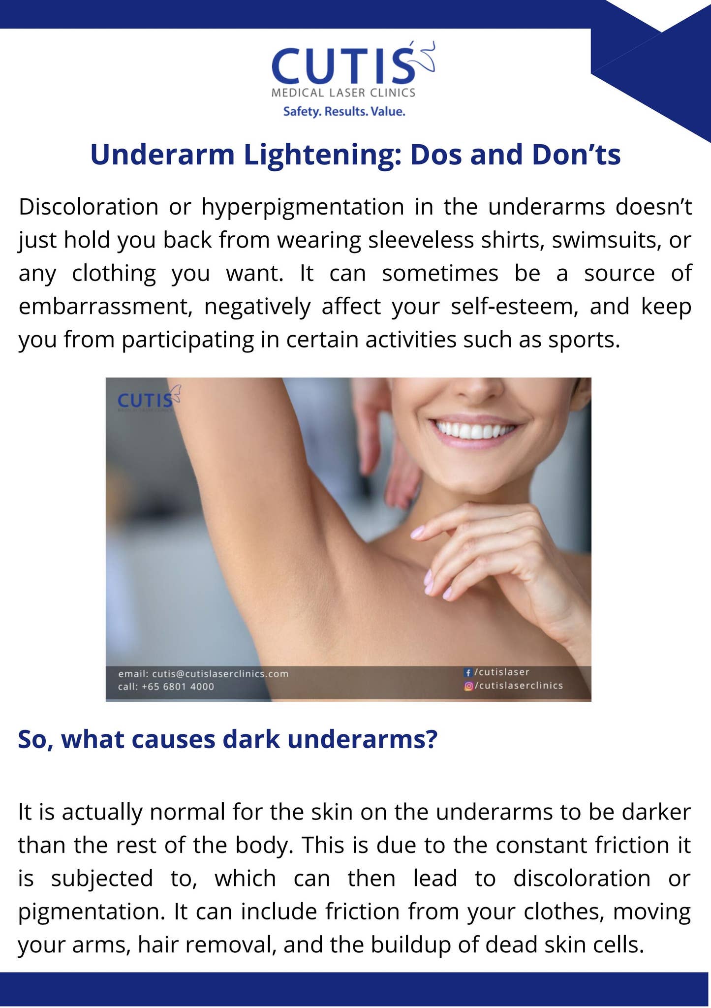 The Dos and Don’ts of Lightening Dark Underarms by cutislaserclinics ...