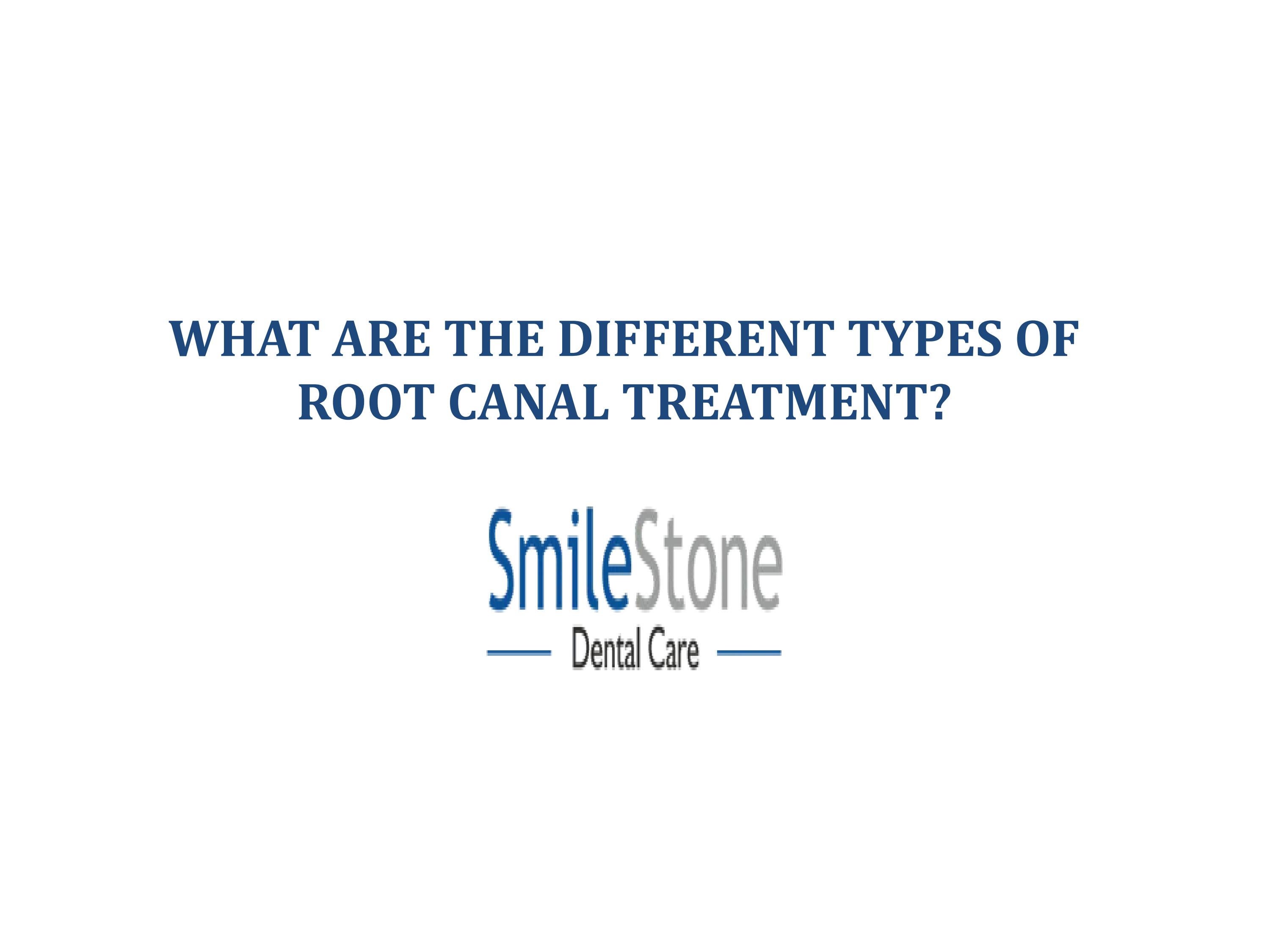 What are the different types of root canal treatment? by Smilestone ...
